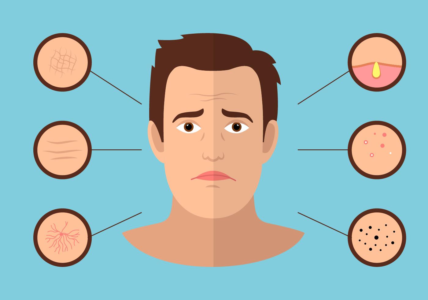Mans Face Problem 162082 Vector Art at Vecteezy