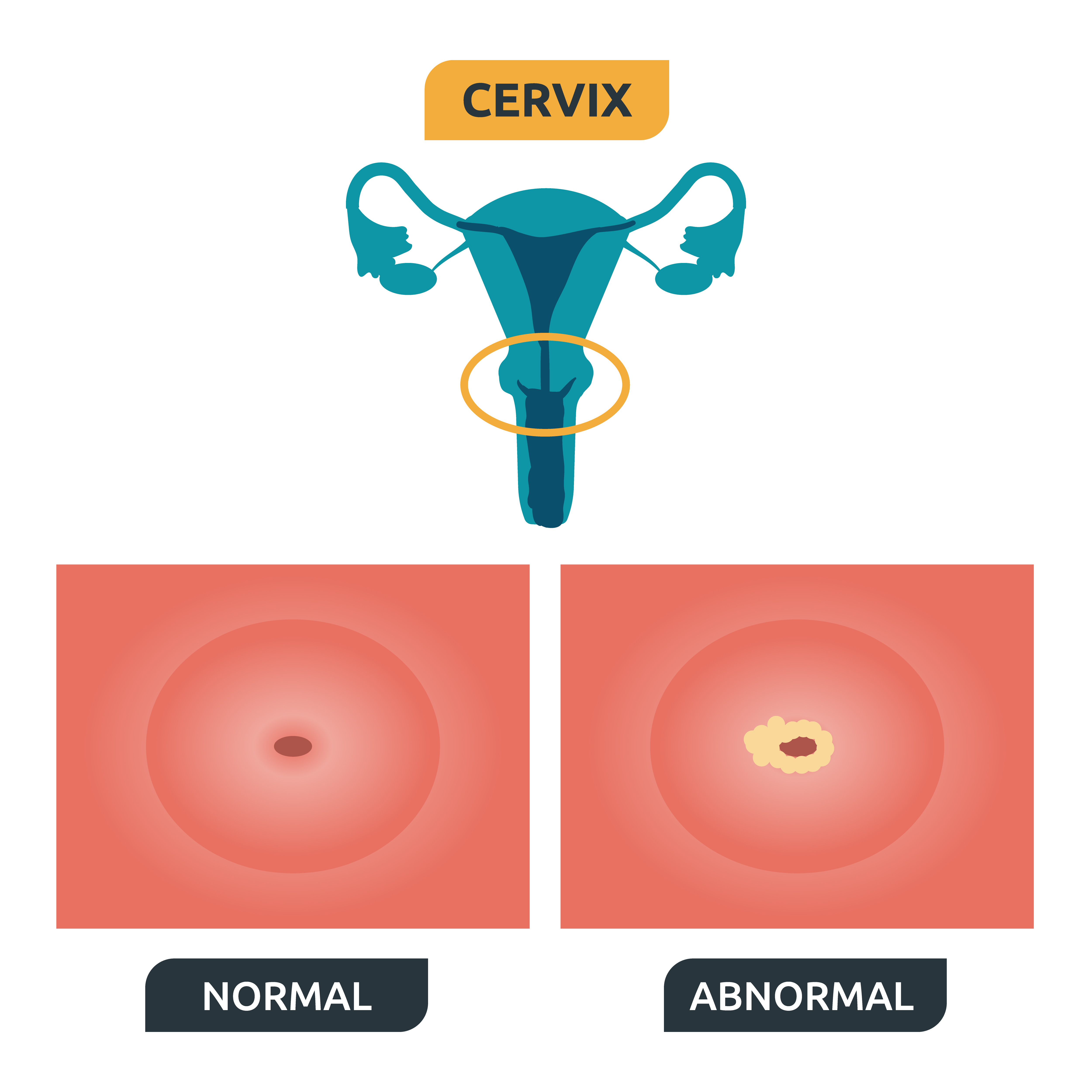 Cervix 548283 Vector Art At Vecteezy