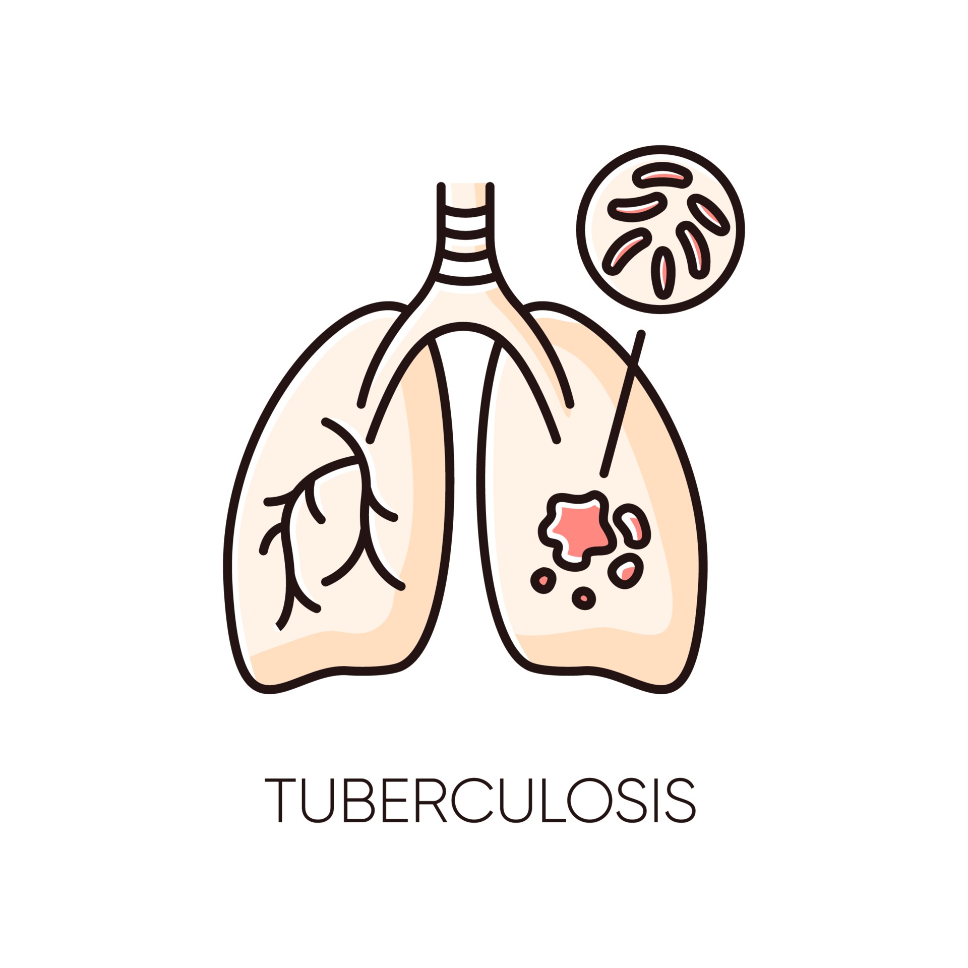 Tuberculosis Rgb Color Icon 3189521 Vector Art At Vecteezy