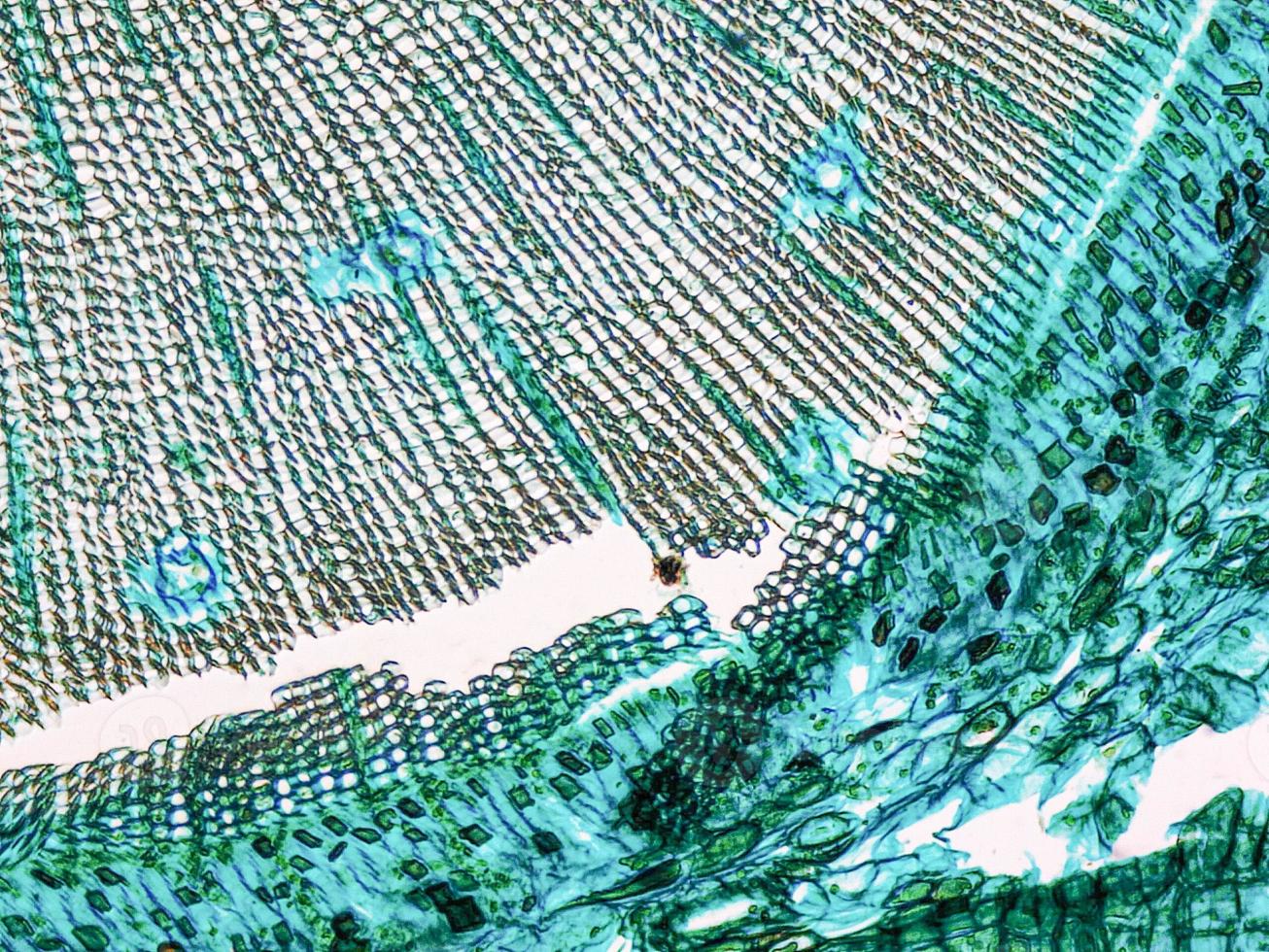 Pine Wood Micrograph 5563989 Stock Photo At Vecteezy pine-wood-micrograph-5563989-stock-photo-at-vecteezy