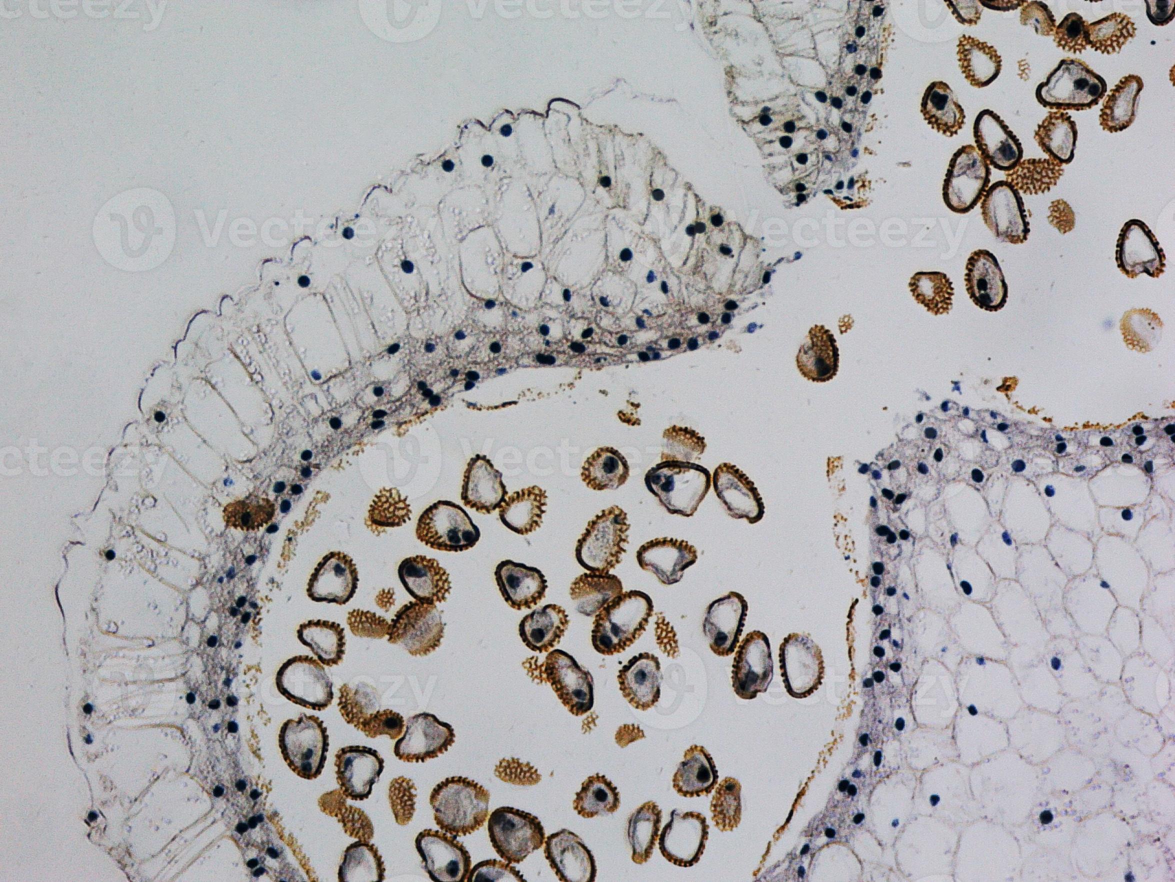 Lily anther micrograph 5565825 Stock Photo at Vecteezy Lily anther micrograph 5565825 Stock Photo at Vecteezy