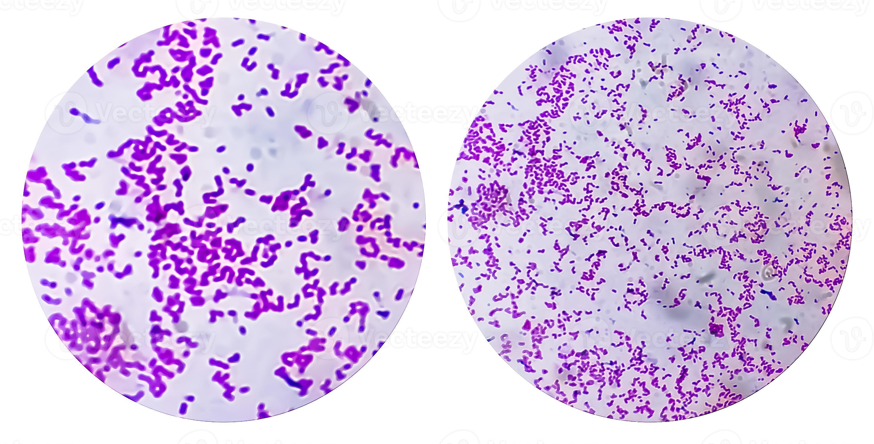 Photo Collage Of Escherichia Coli Bacterium Li Gram Negative Rod Shaped Bacteria Part Of