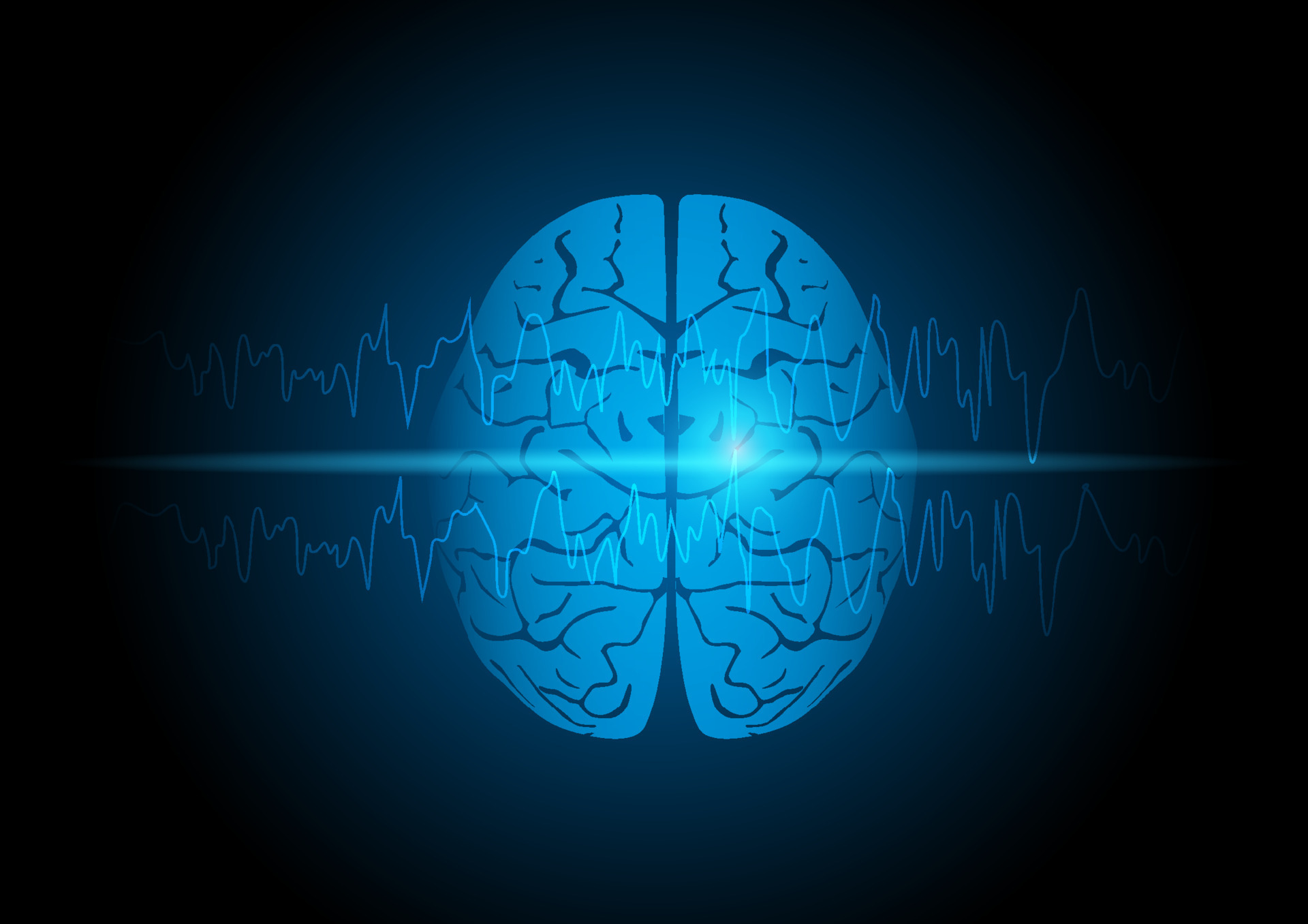 Illustration of focal seizure and human brain 6861937 Vector Art at ...