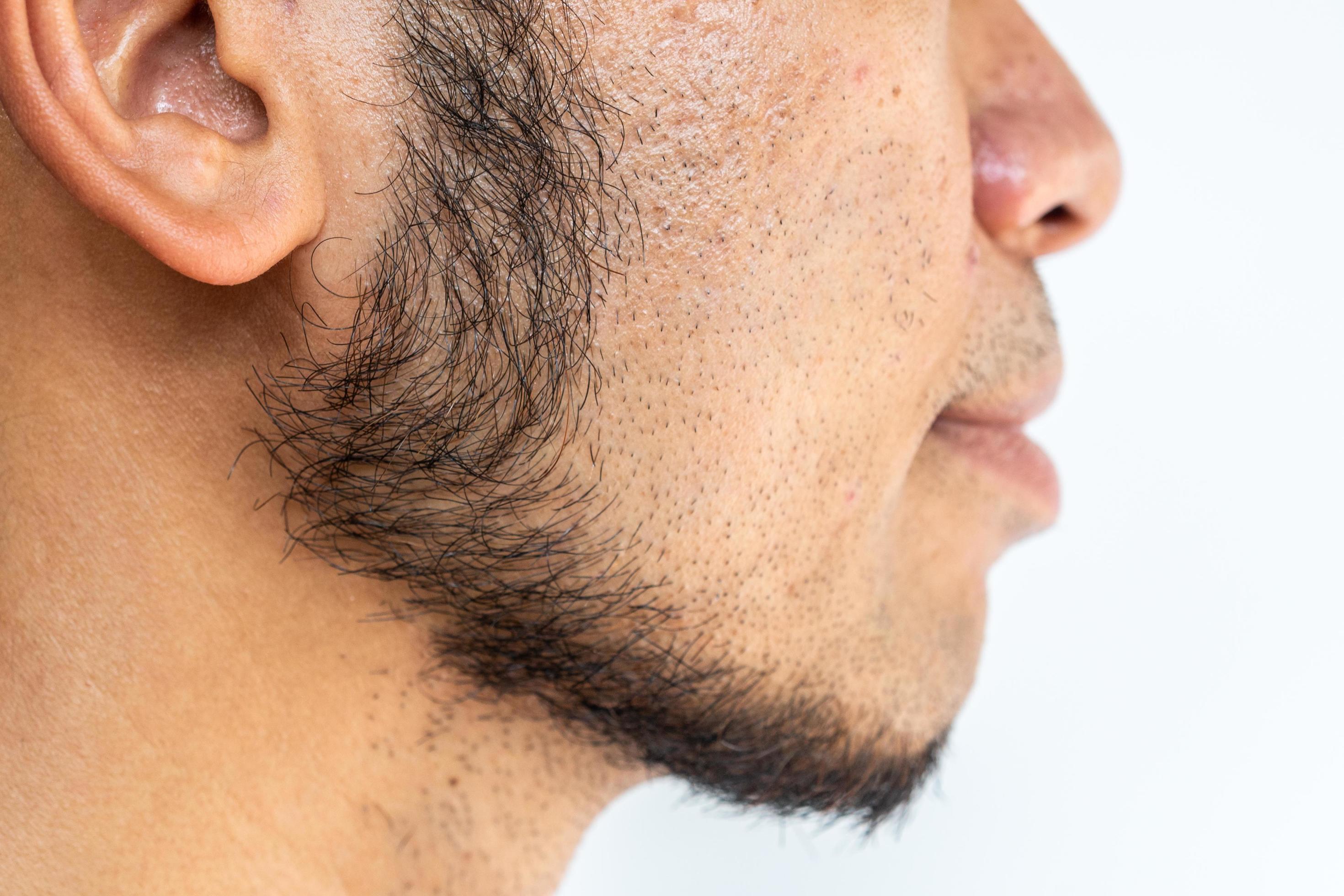 Side view of Asian man face with beard grows on a part of his face ...