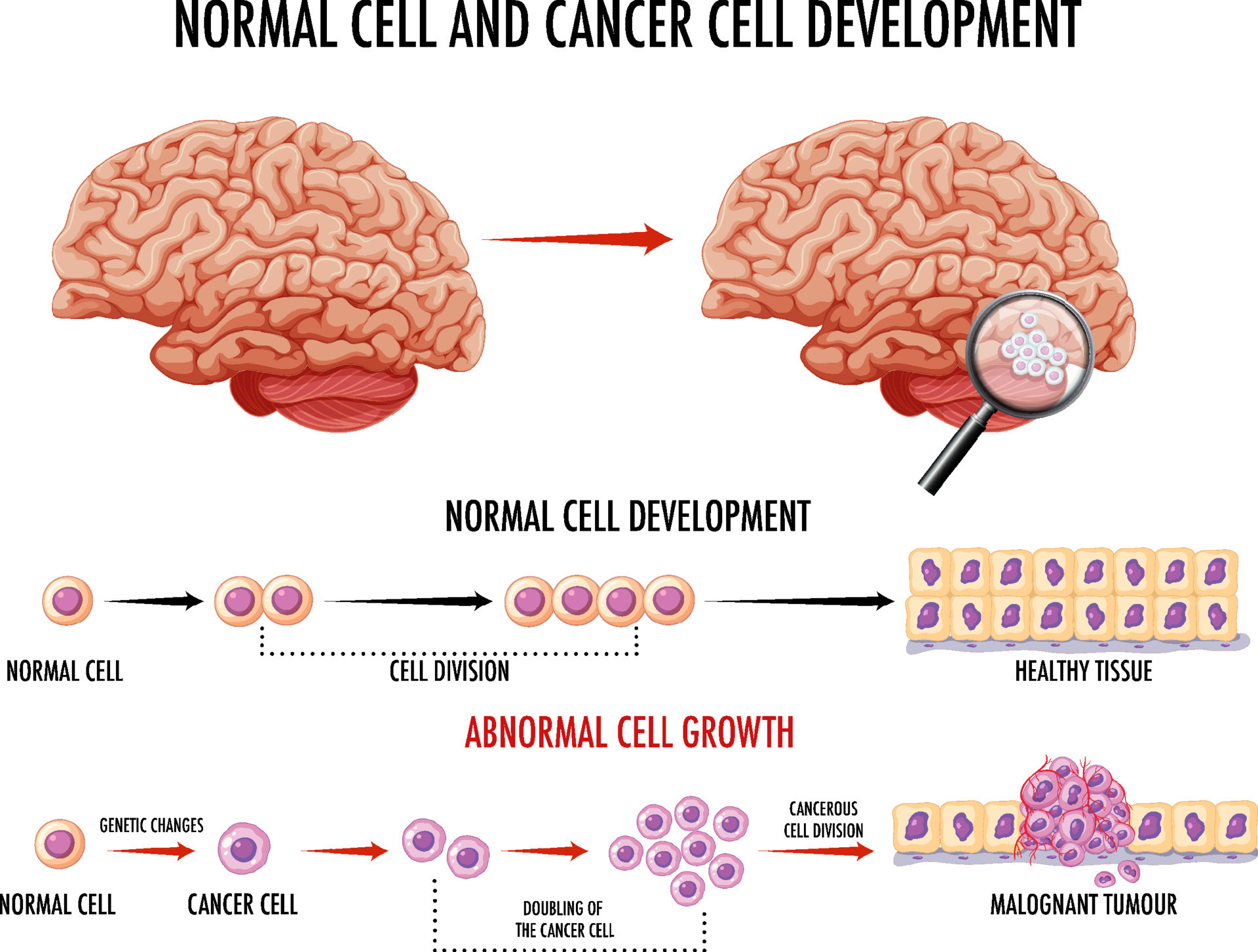 Diagram Showing Normal And Cancer Cells In Human 7375053 Vector Art At Vecteezy