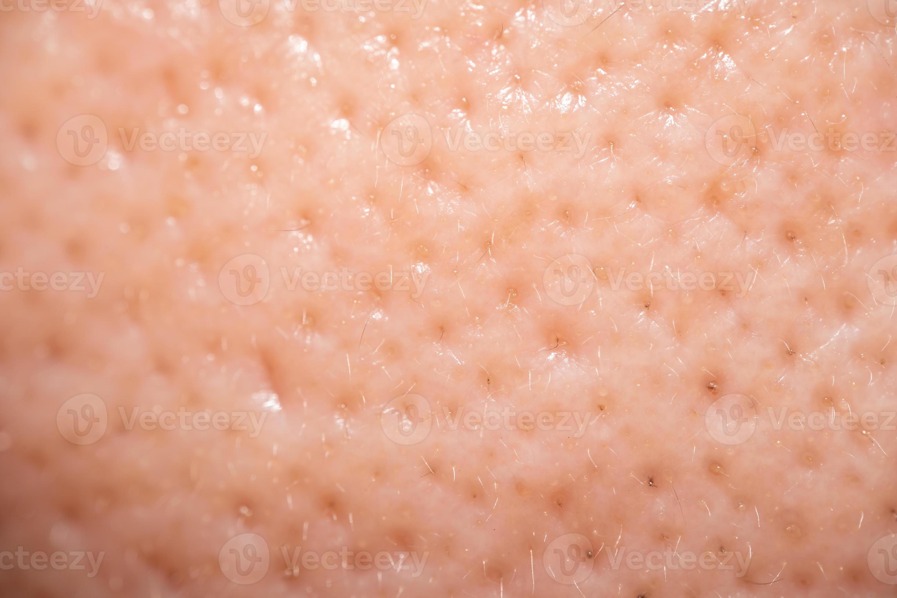 Asian male nose and cheek close up has skin problem, large pores ... Asian male nose and cheek close up has skin problem, large pores ...