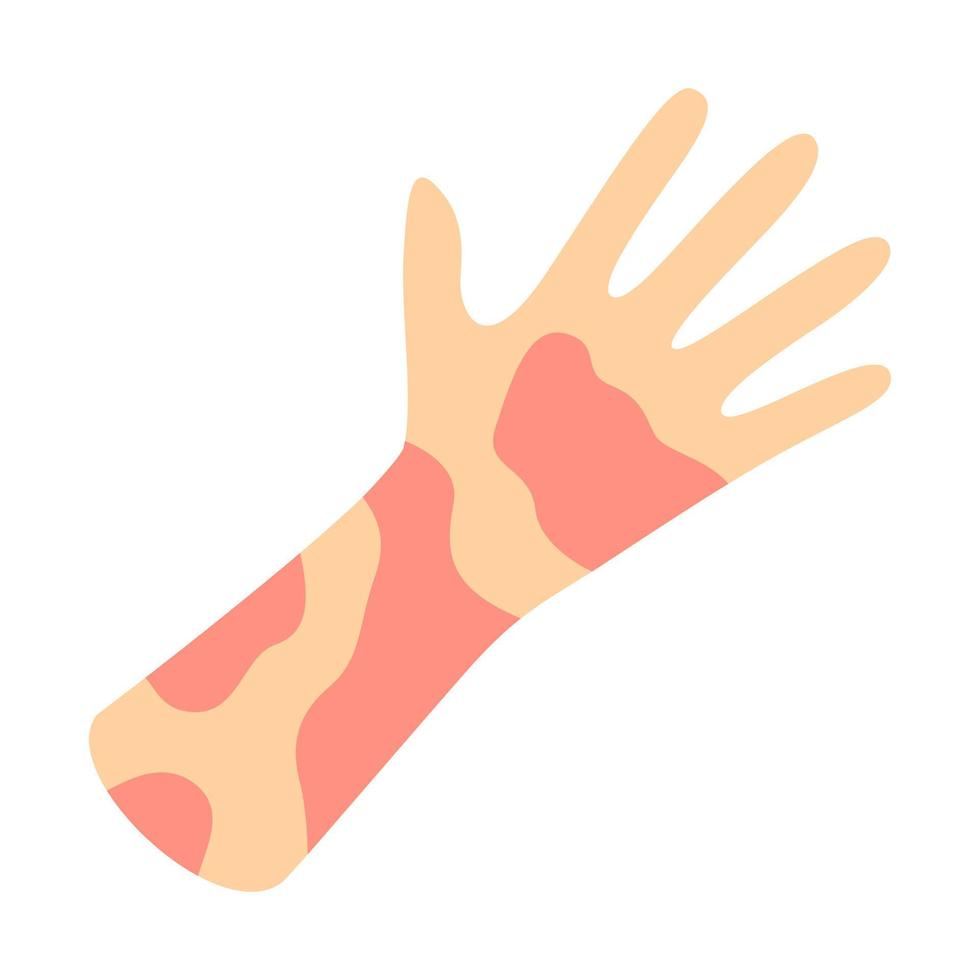 Contact Dermatitis Flat Design Long Shadow Color Icon Skin Redness