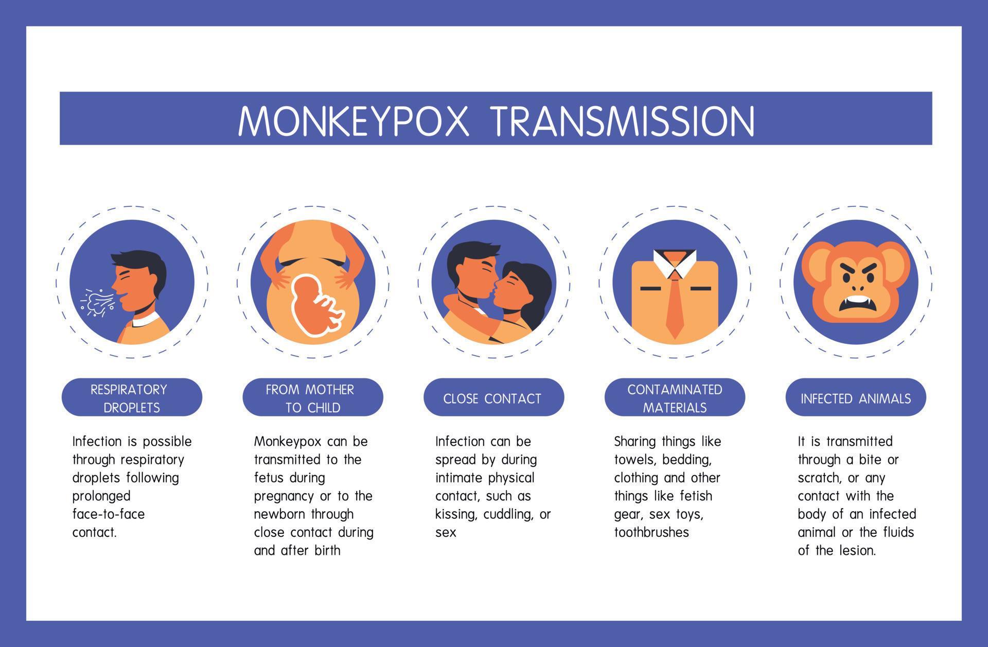 Infographic of monkeypox virus transmission, close contact, foreign objects, respiratory tract ...