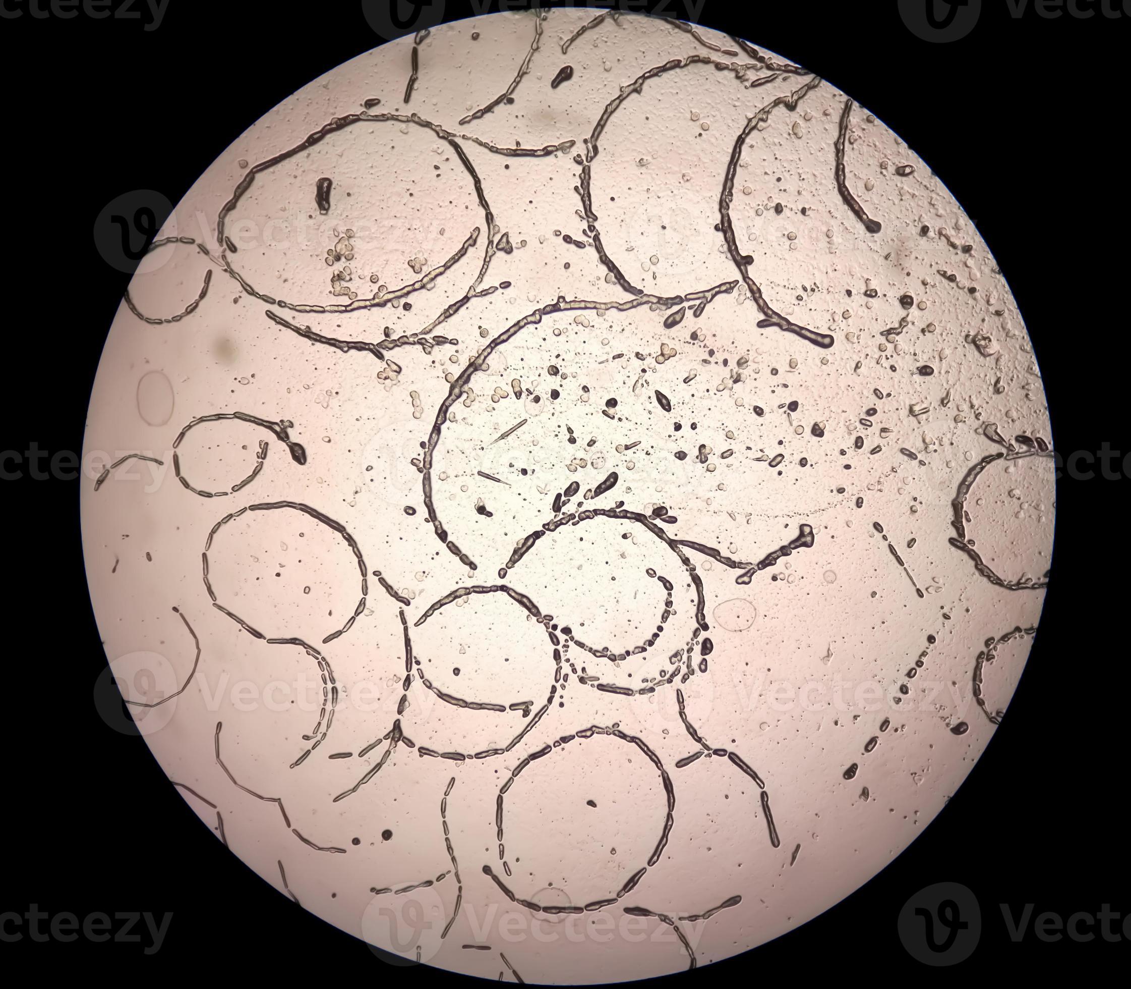 Imagen Microscópica Que Muestra Hifas De Dermatofitos Raspado De Piel Para Prueba De Hongos