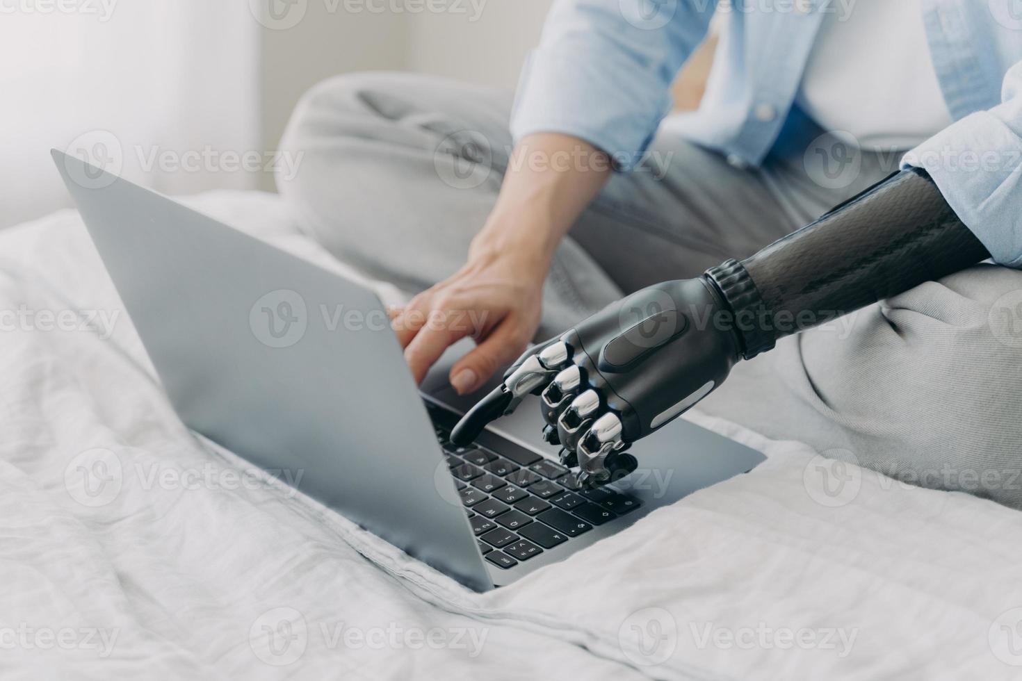 Close up of disabled woman working on laptop, typing on keyboard, using bionic prosthetic arm ...