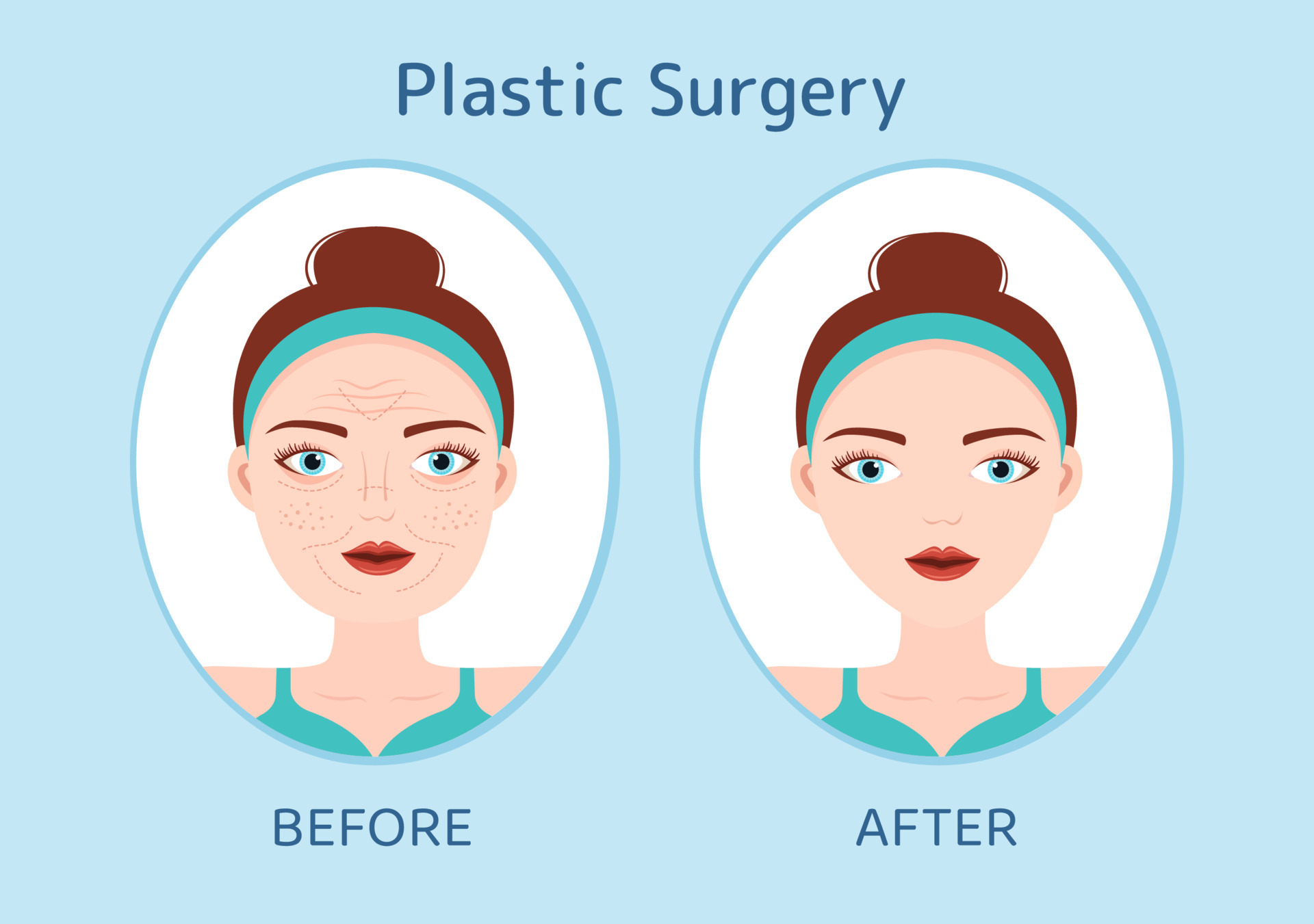 Plastic Surgery Flat Cartoon Hand Drawn Templates Illustration Of