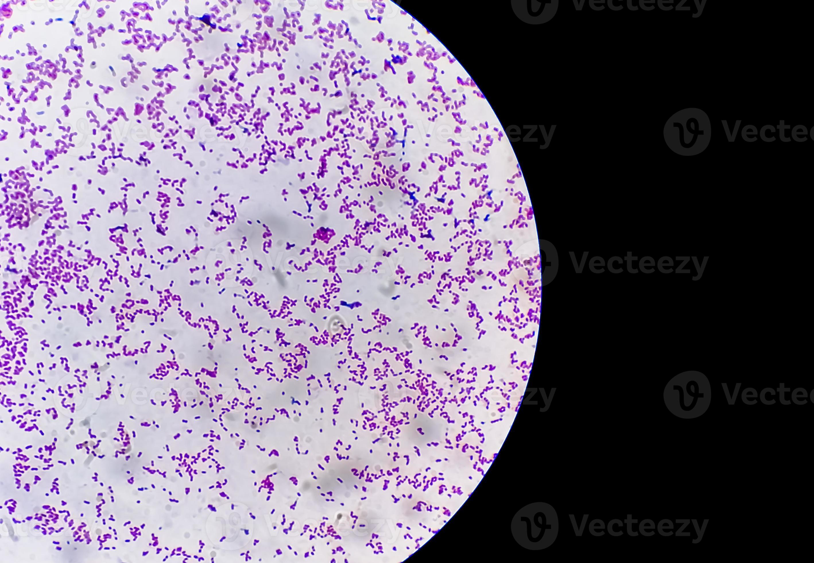 Gram staining, also known as Gram's method, is a method of ... Gram staining, also known as Gram's method, is a method of ...