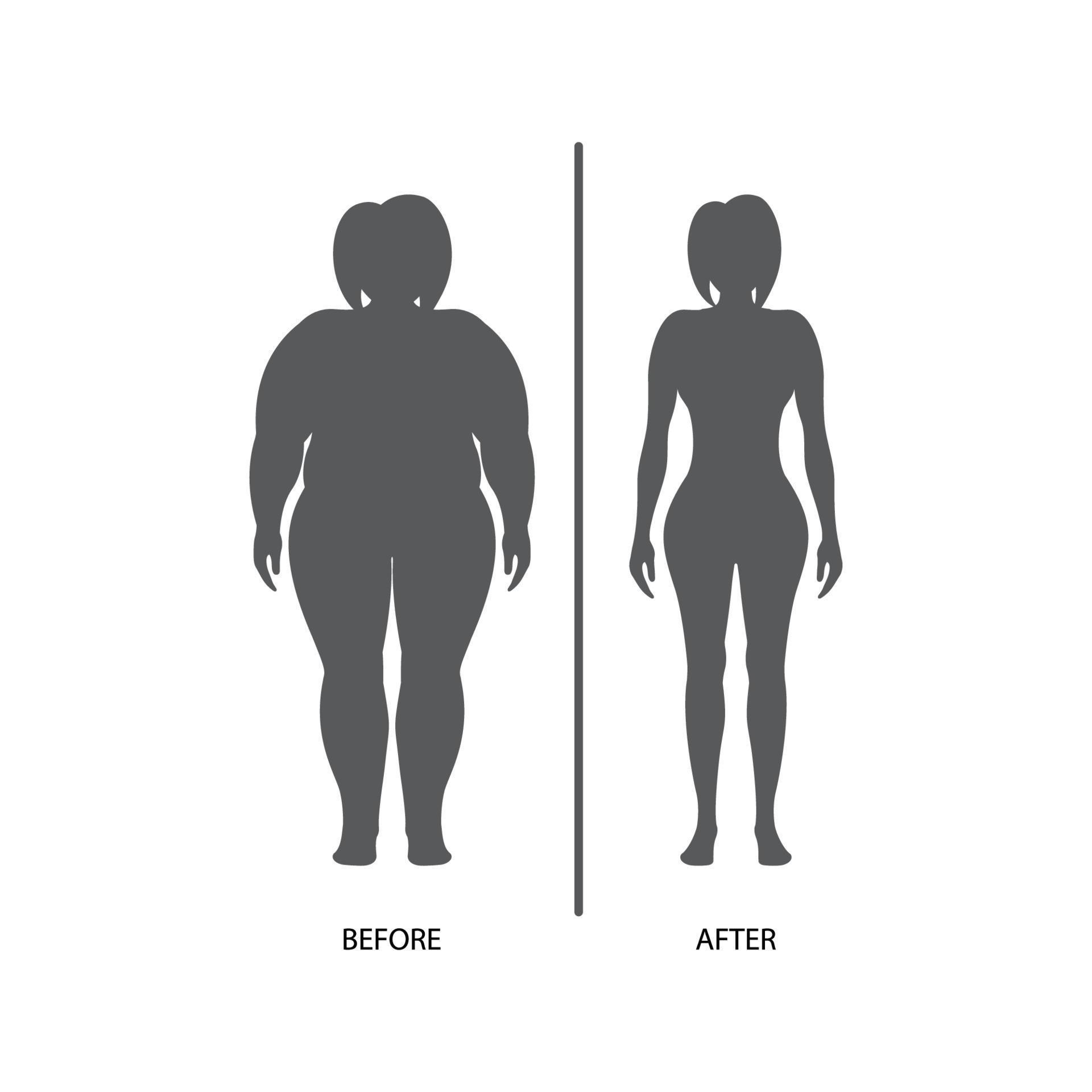 Body Mass Index Vector Illustration 14290925 Vector Art At Vecteezy
