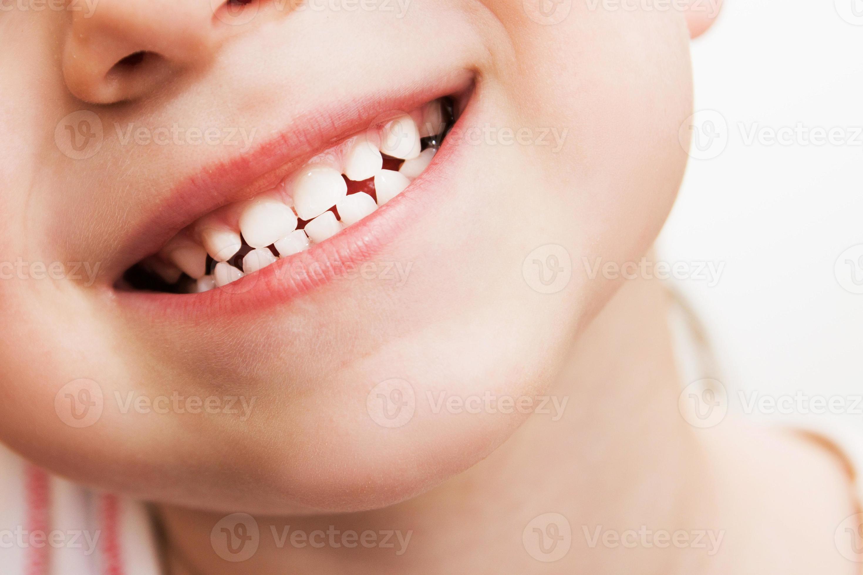 baby smile close. child teeth on a white isolated background. 15684523 ...