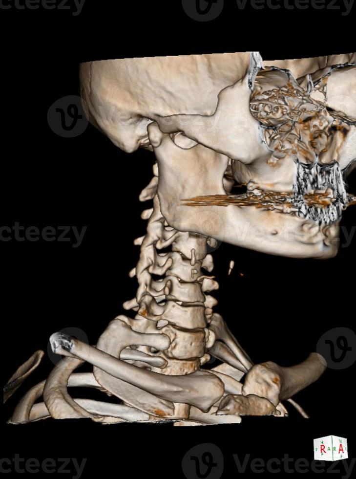 CT Scan cervical spine 3 D render . 15763235 Stock Photo at Vecteezy