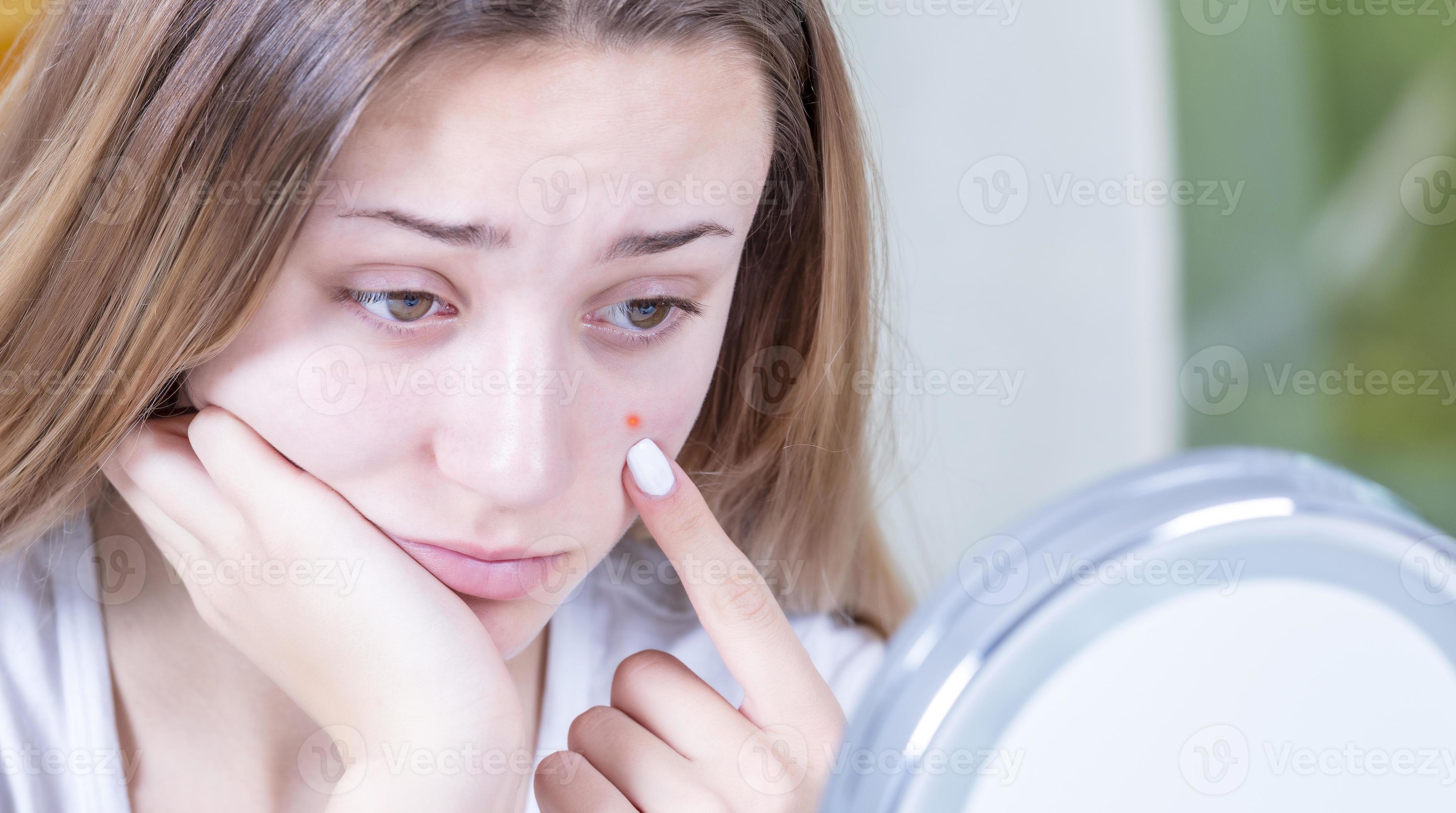 Checking Problematic Face Skin At Home Young Teenager With Self Issues Looking Into Mirror