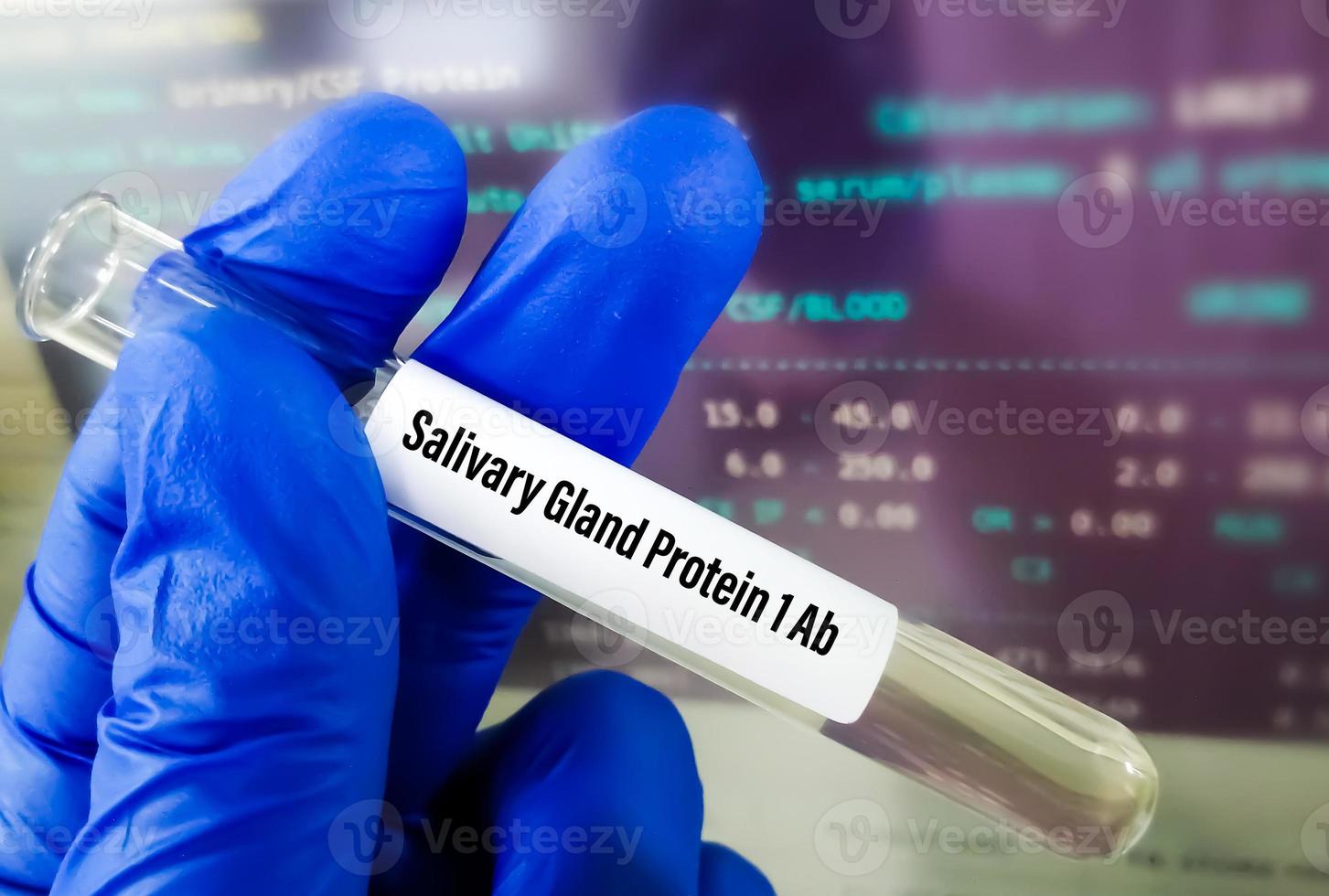 Scientist holding sample for salivary protein Ab test. salivary protein ... Scientist holding sample for salivary protein Ab test. salivary protein ...