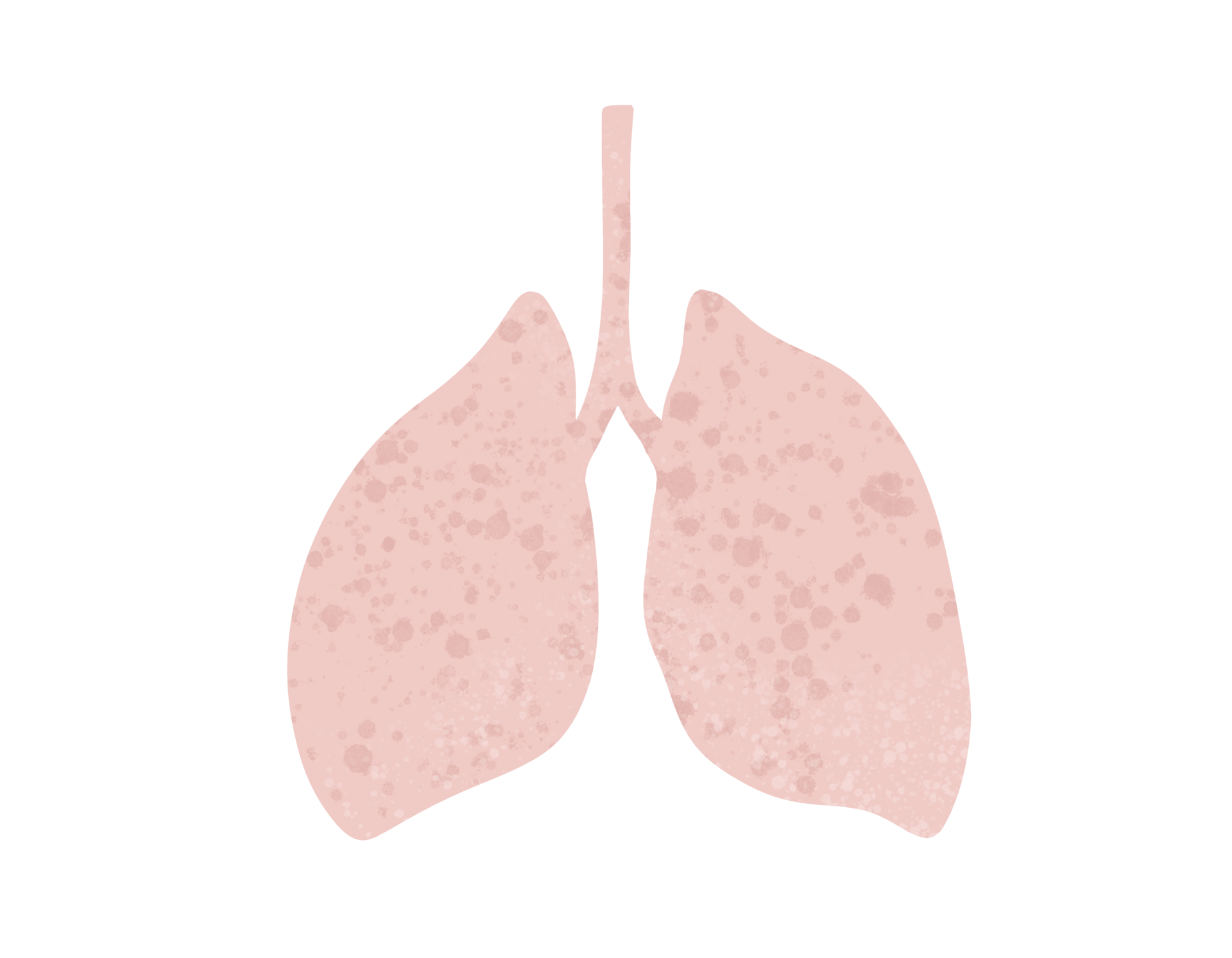 set of Lung Graphical representation of infectious pneumonia 19786667 PNG set of Lung Graphical representation of infectious pneumonia 19786667 PNG