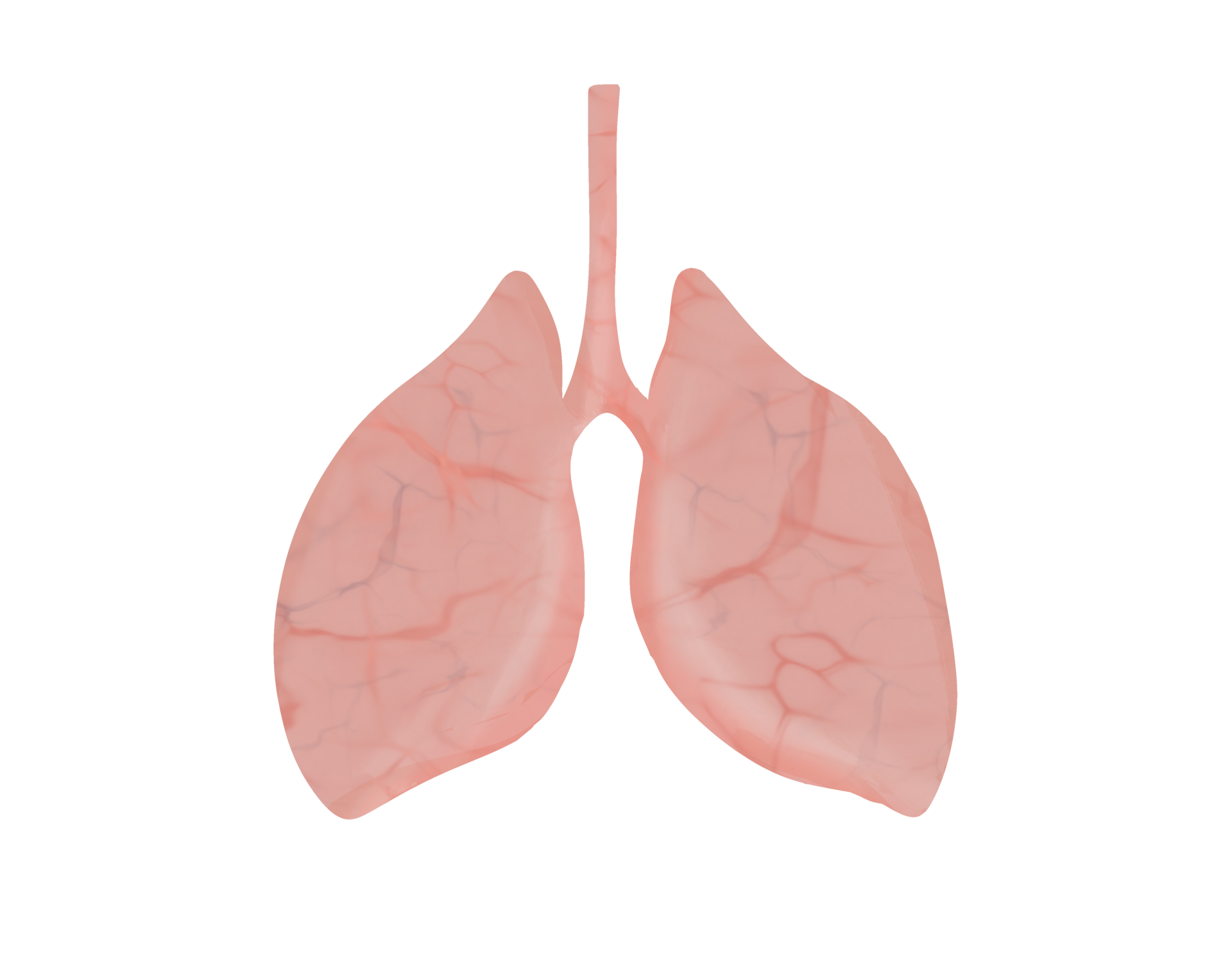 set of Lung Graphical representation of infectious pneumonia 19786679 PNG set of Lung Graphical representation of infectious pneumonia 19786679 PNG