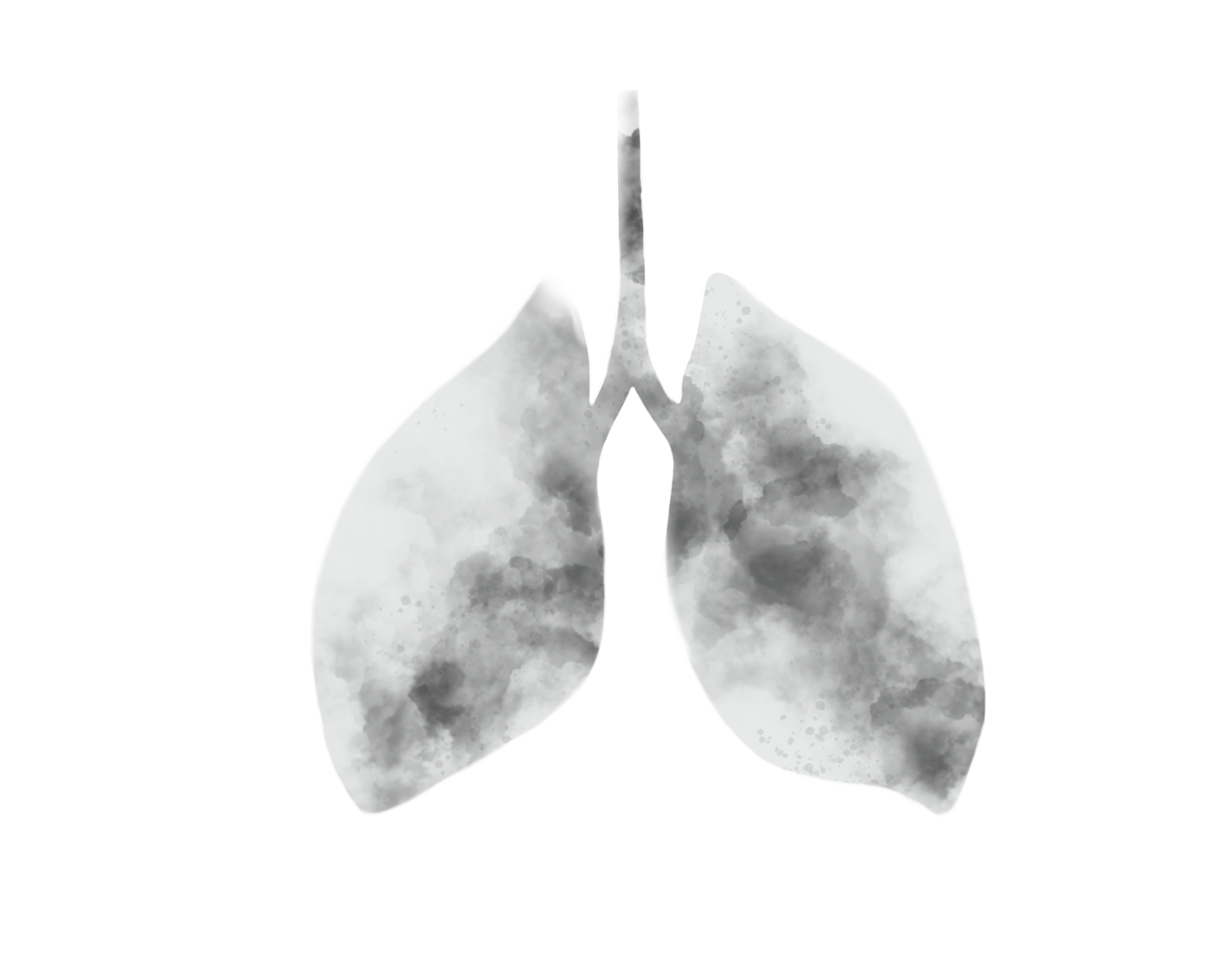 set of Lung Graphical representation of infectious pneumonia 19786685 PNG set of Lung Graphical representation of infectious pneumonia 19786685 PNG