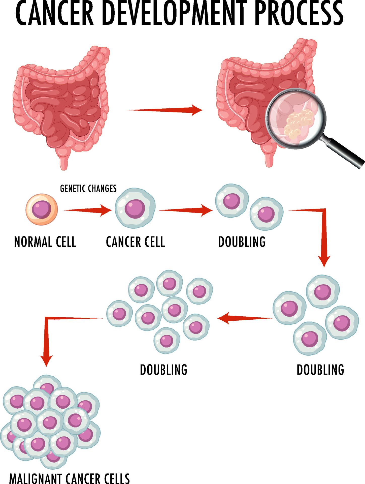 Diagram Showing Normal And Cancer Cells In Human 19850181 Vector Art At diagram-showing-normal-and-cancer-cells-in-human-19850181-vector-art-at
