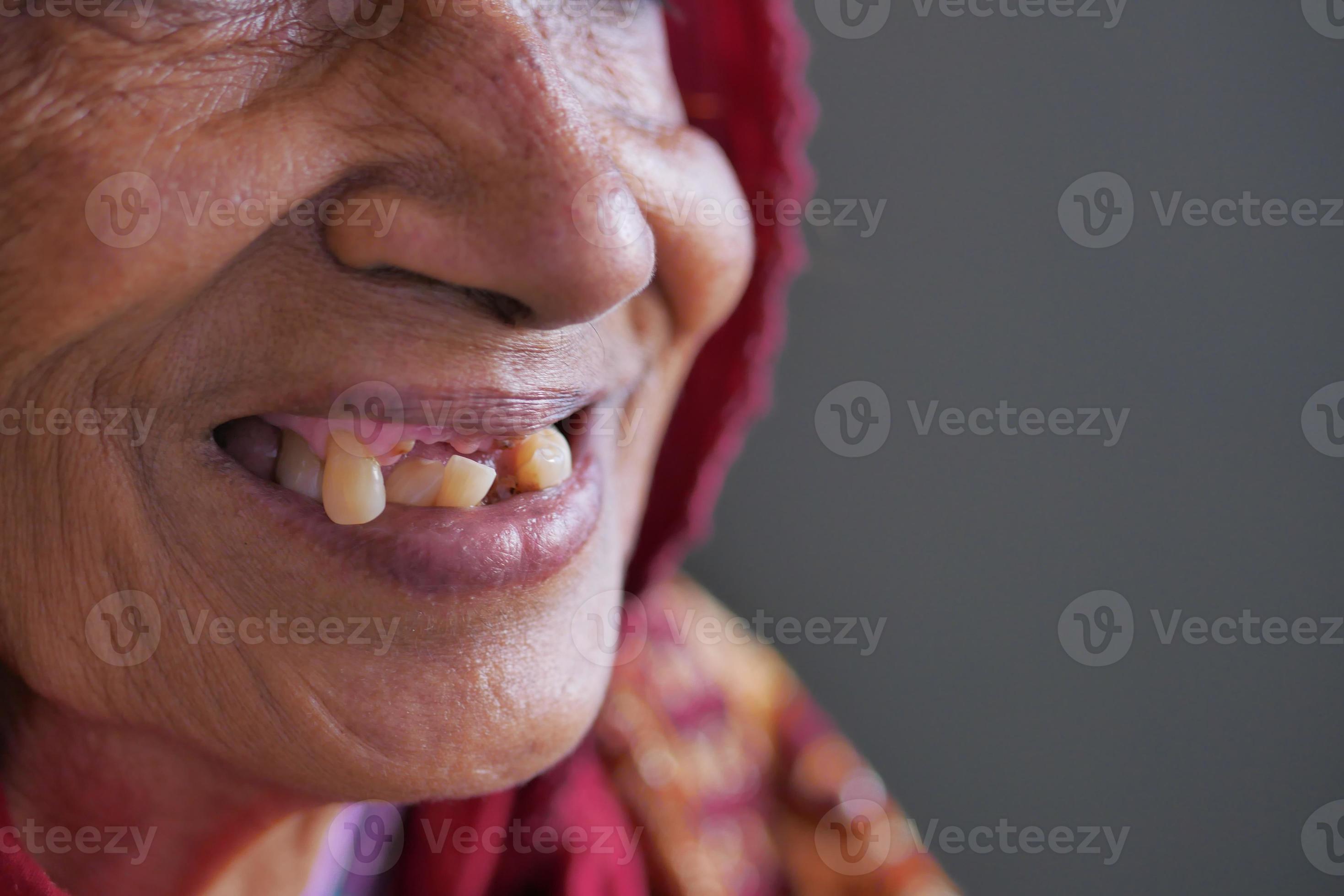 Senior Woman Smiling With Deformed Teeth. 22138175 Stock Photo at Vecteezy