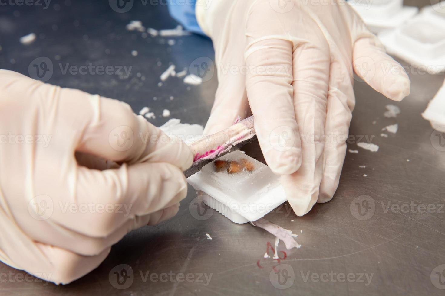 Scientist preparing paraffin blocks containing biopsy tissue for ... Scientist preparing paraffin blocks containing biopsy tissue for ...