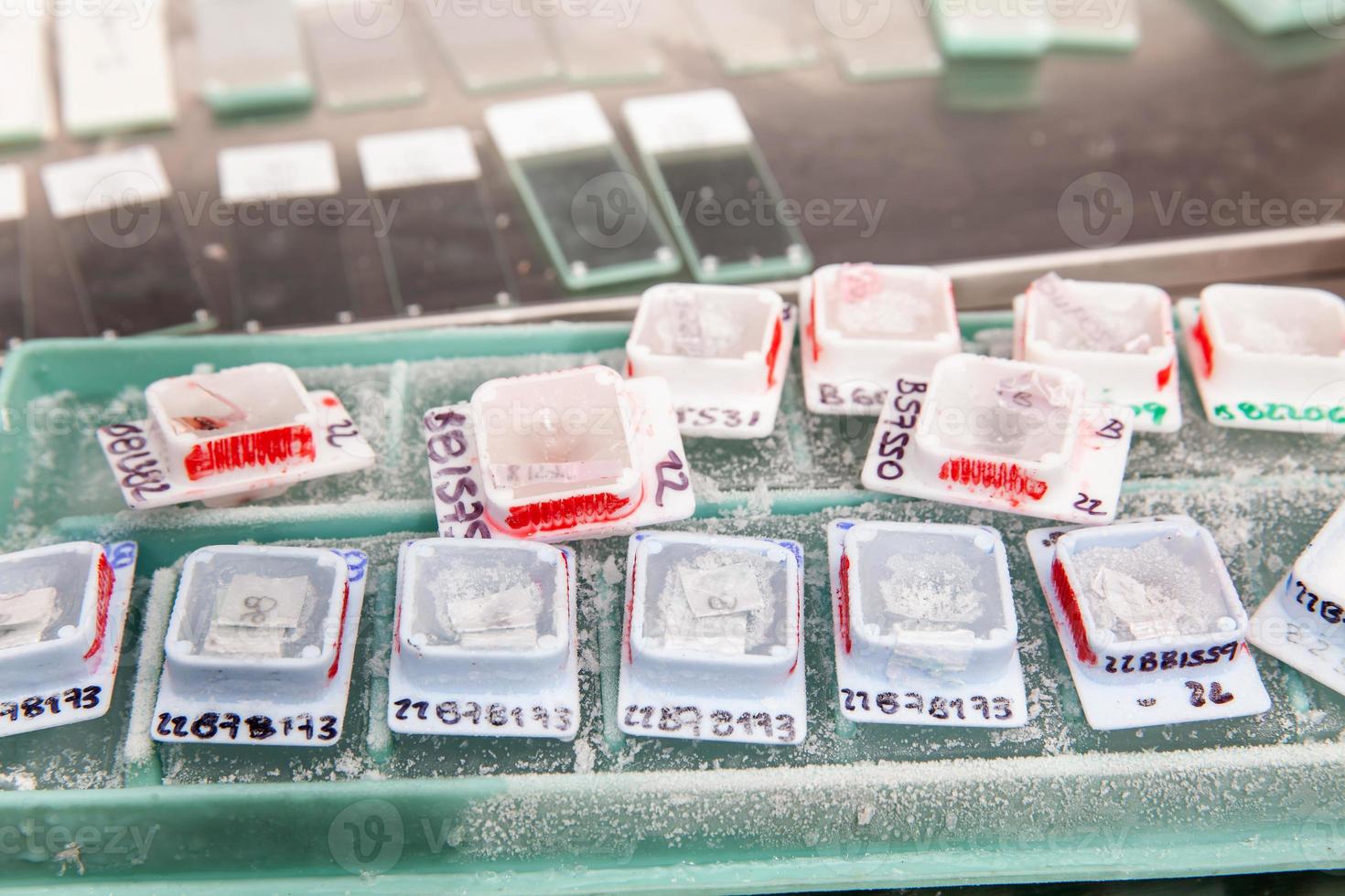 Frozen Blocks Of Paraffin Embedded Tissue Kept Cold On Ice Ready To Be