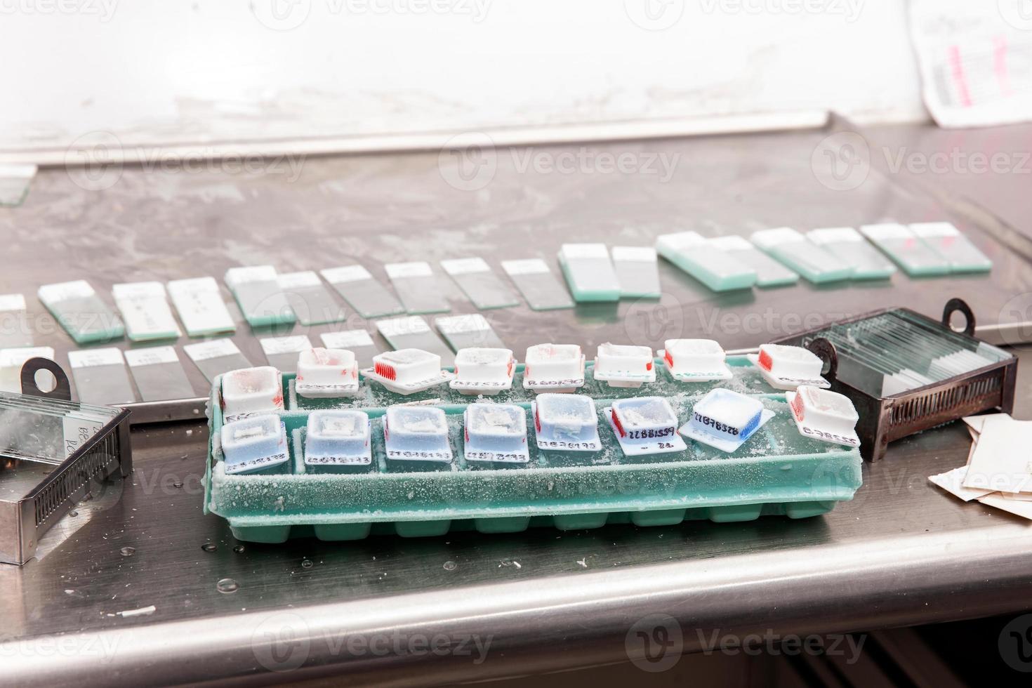 Frozen Blocks Of Paraffin Embedded Tissue Kept Cold On Ice Ready To Be Cut Using A Microtome