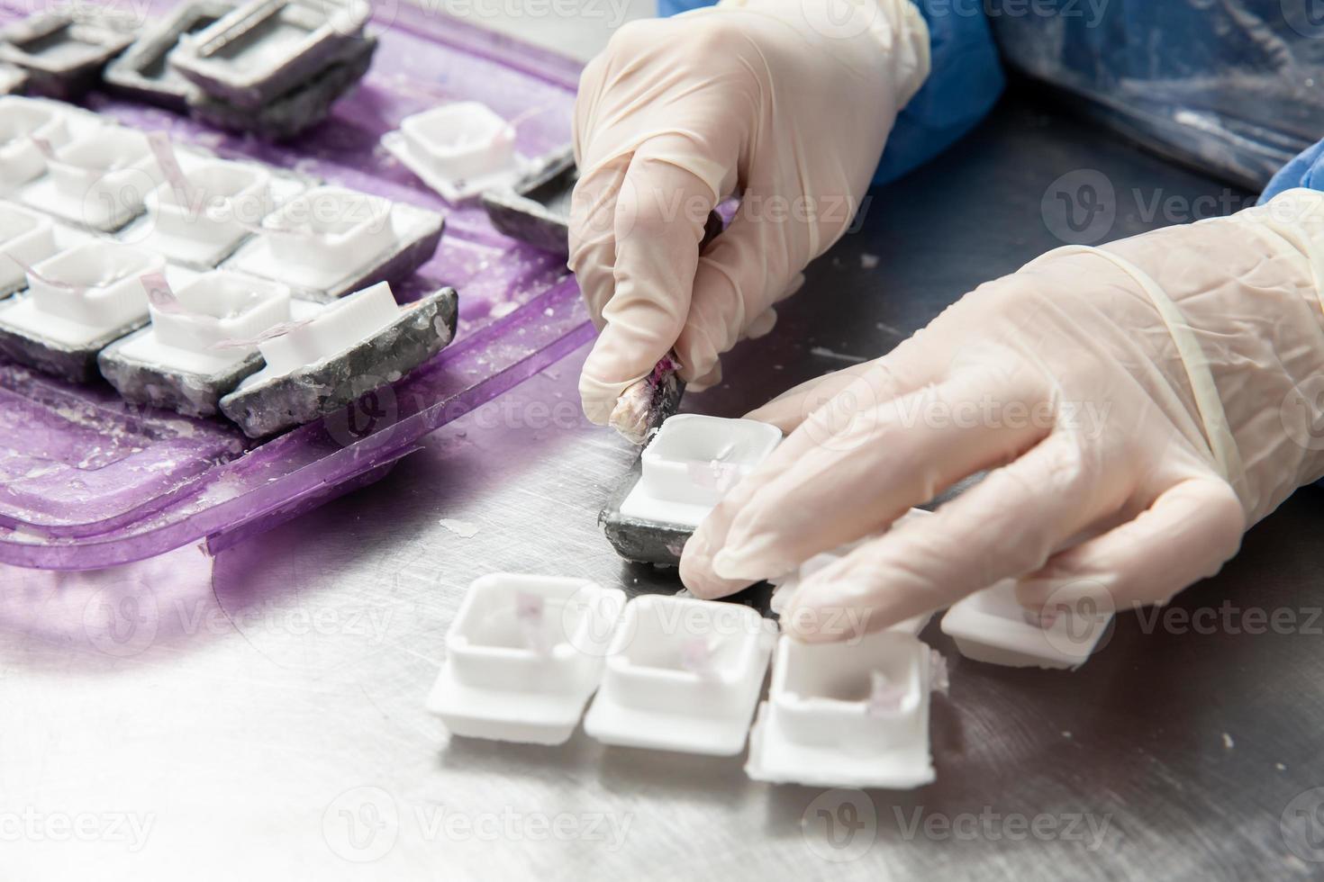 Scientist preparing paraffin blocks containing biopsy tissue for ... Scientist preparing paraffin blocks containing biopsy tissue for ...