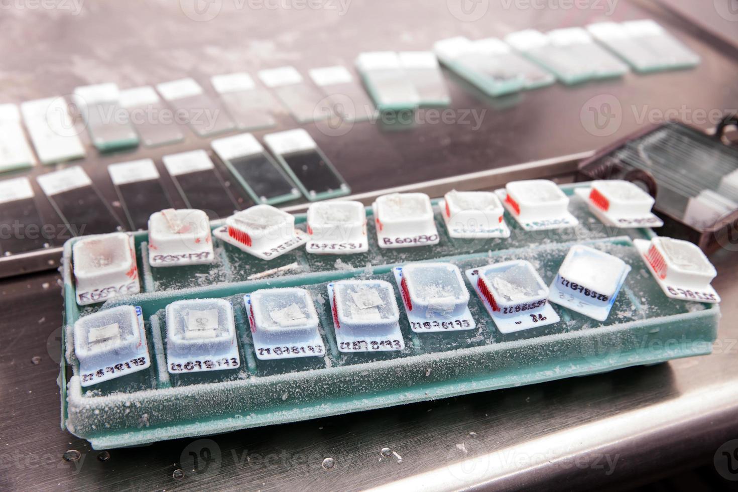 Frozen Blocks Of Paraffin Embedded Tissue Kept Cold On Ice Ready To Be