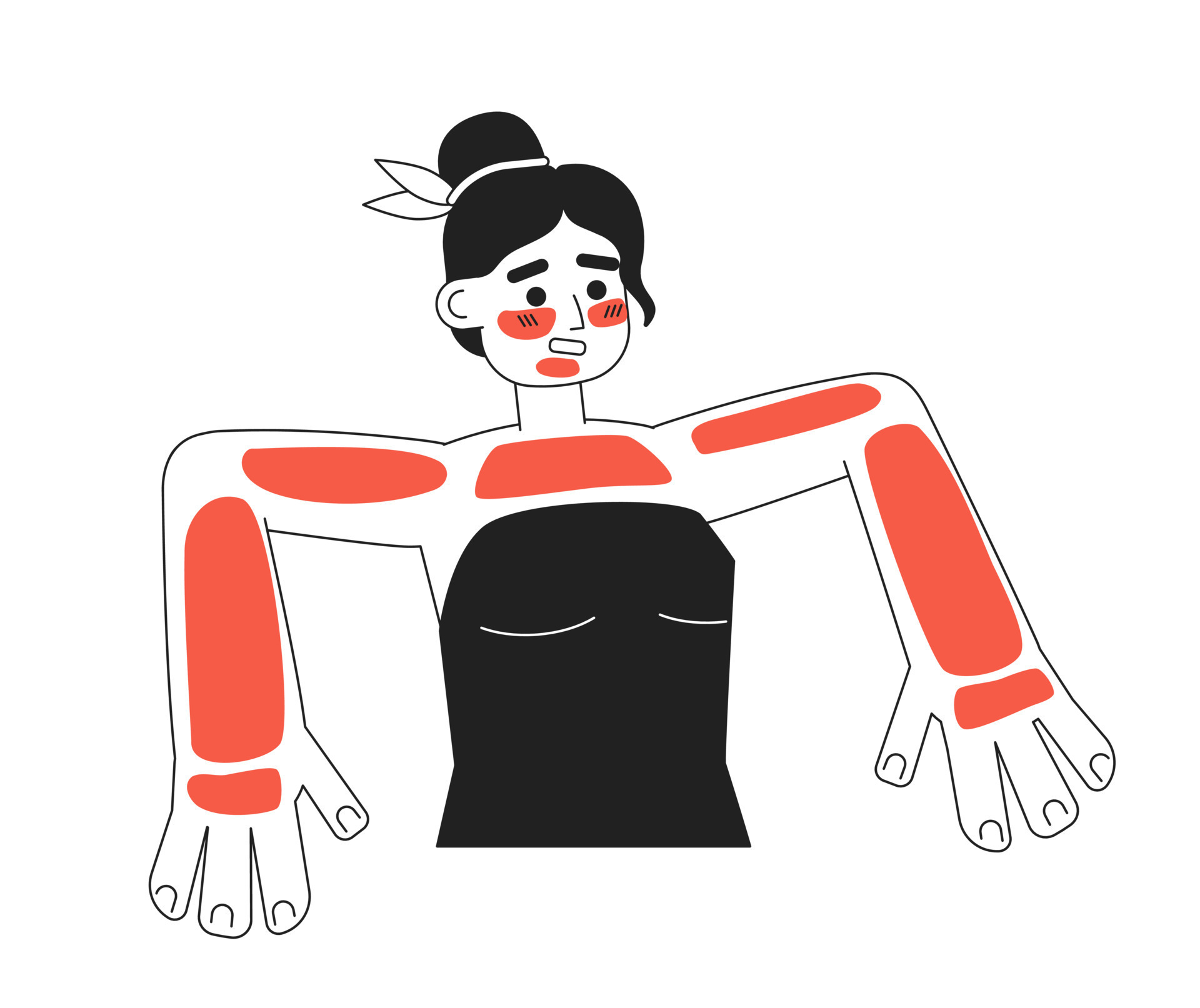 Young Woman With Severe Sunburns Monochromatic Flat Vector Character