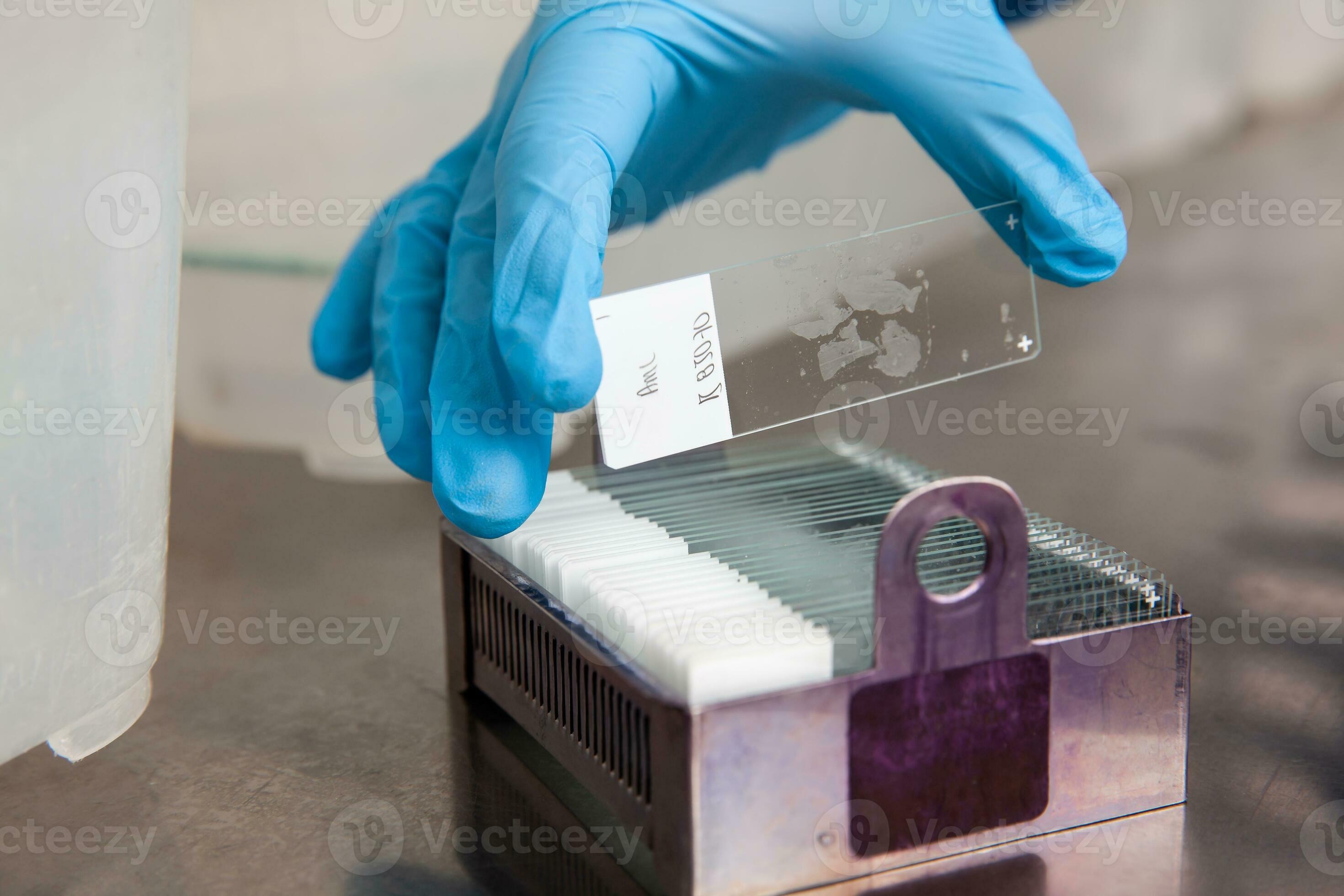 Scientist placing slides with paraffin embedded tissue samples into a slide staining rack ...