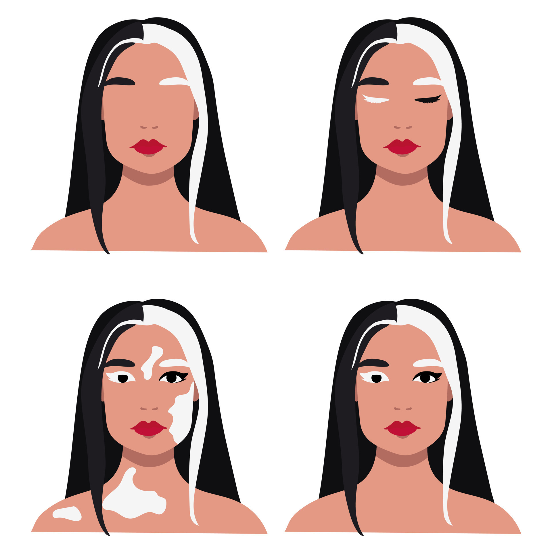 A set of cute stylized girls with partial albinism, piebaldism, and straight black and white ...