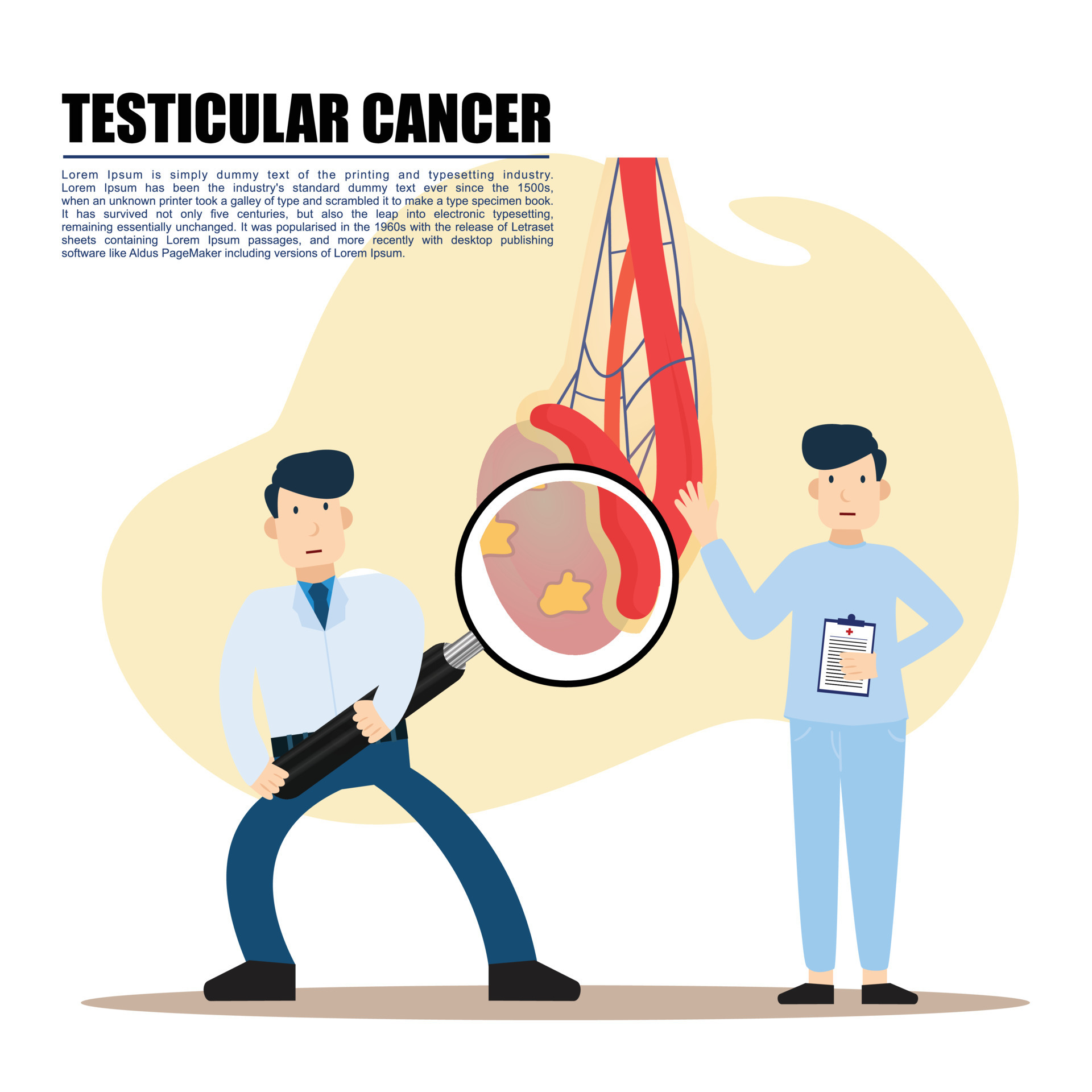 A Male Anatomy Of Testicular Cancer 23959517 Vector Art At Vecteezy