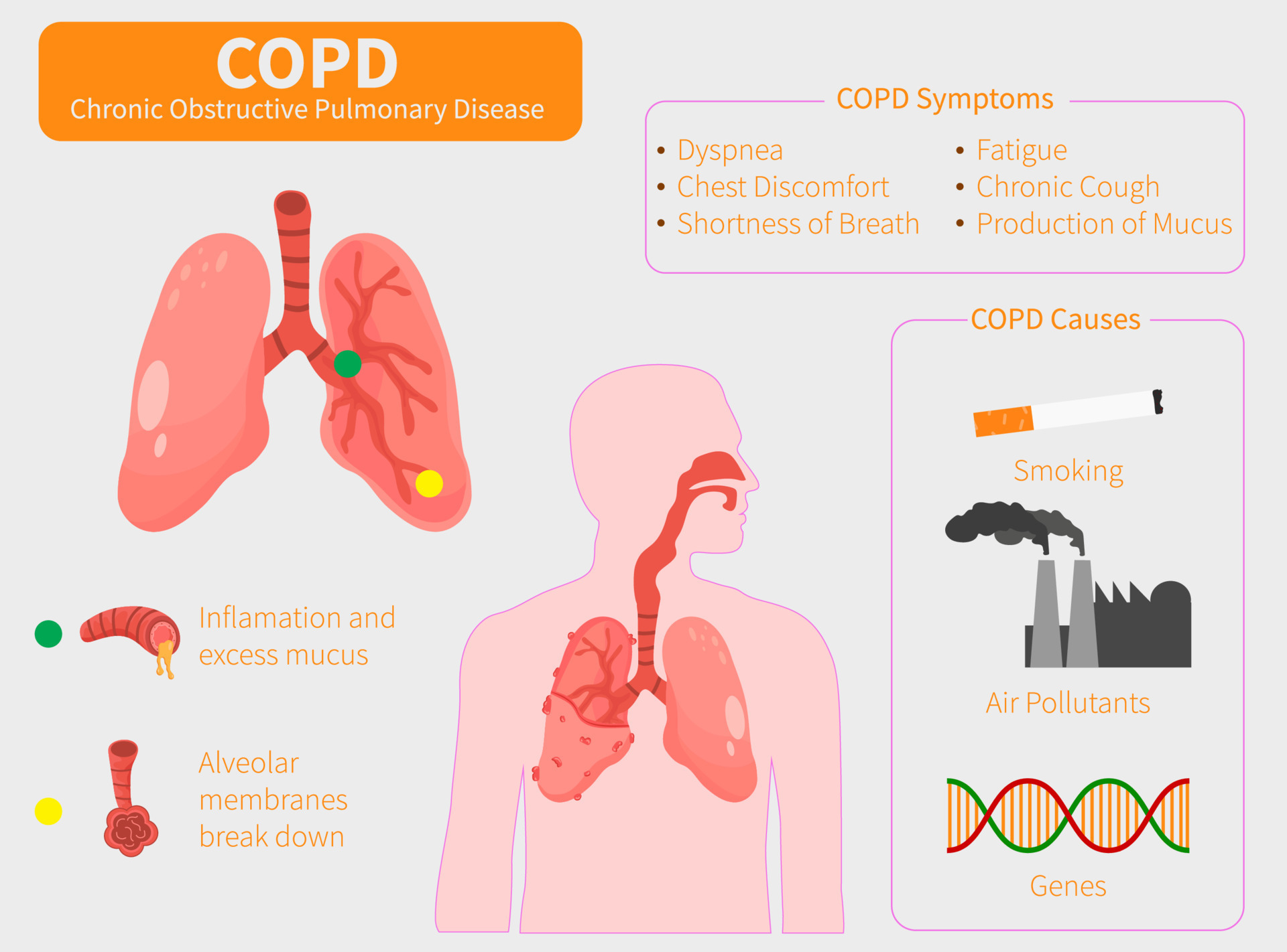 Human Lungs Vector Clip Art Icon Copd Vector Illustration Chronic Obstructive Pulmonary