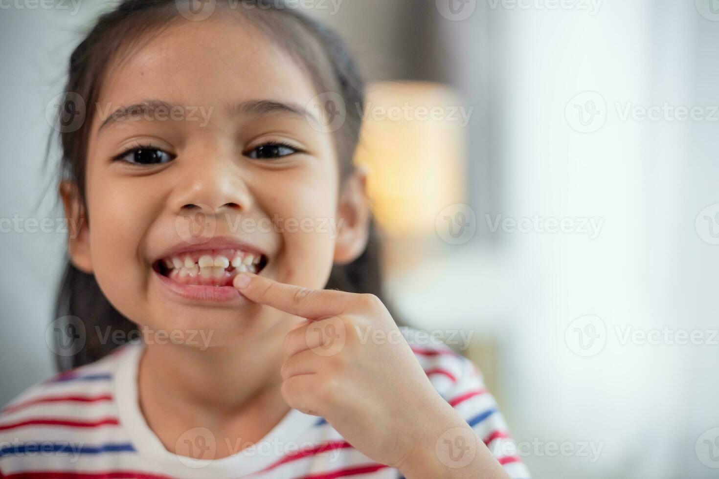 Little Asian girl showing her broken milk teeth. 24868976 Stock Photo ... Little Asian girl showing her broken milk teeth. 24868976 Stock Photo ...