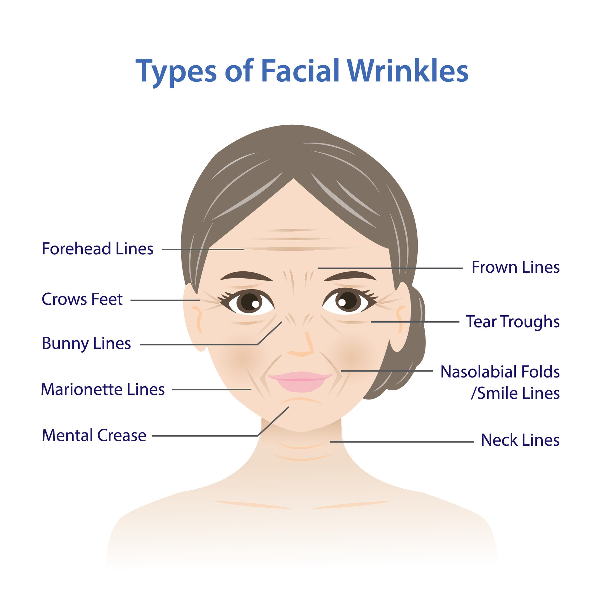 Face Lines And What They Mean at Pam Kirkland blog
