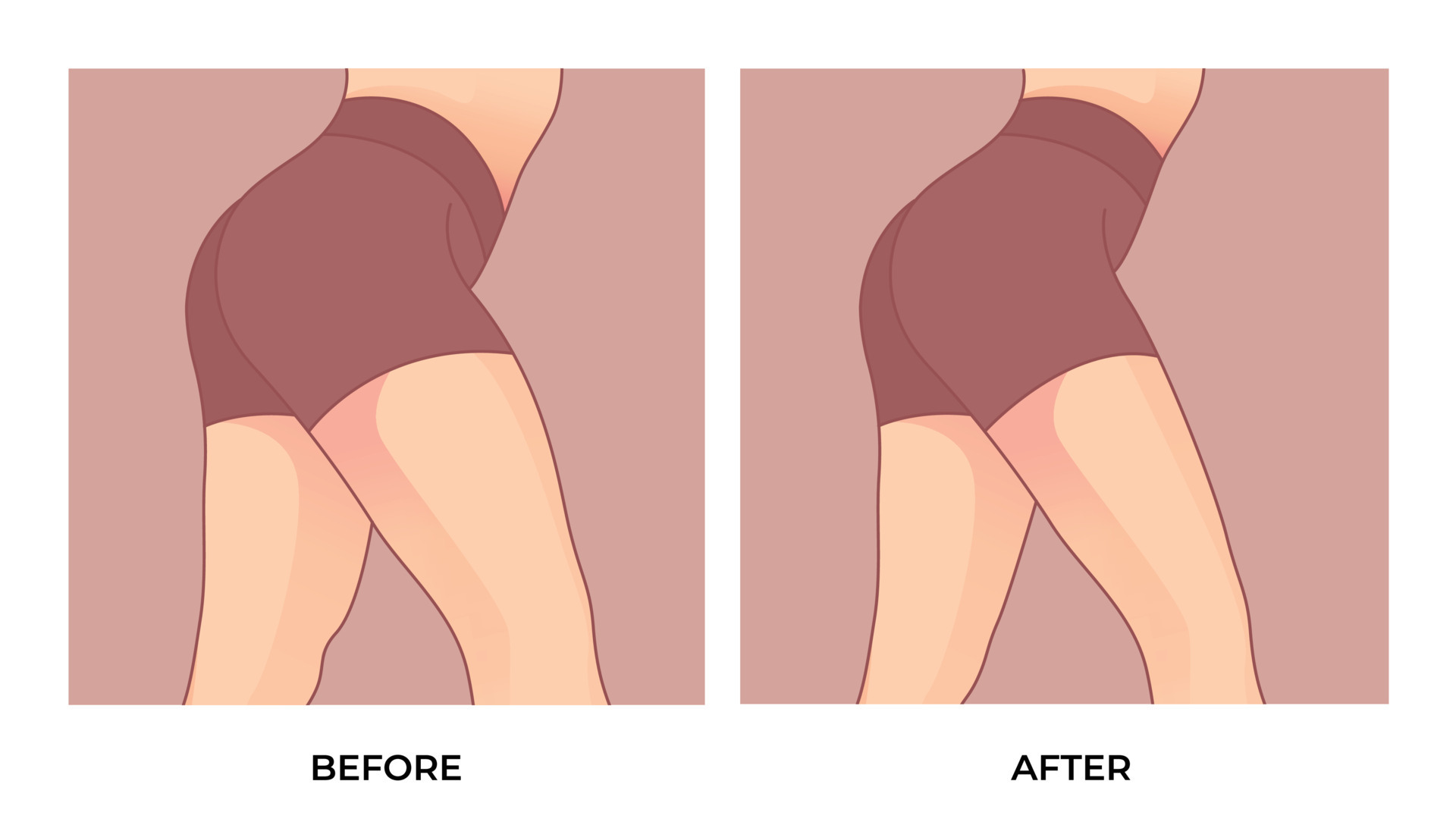 Toned Female Body Before After