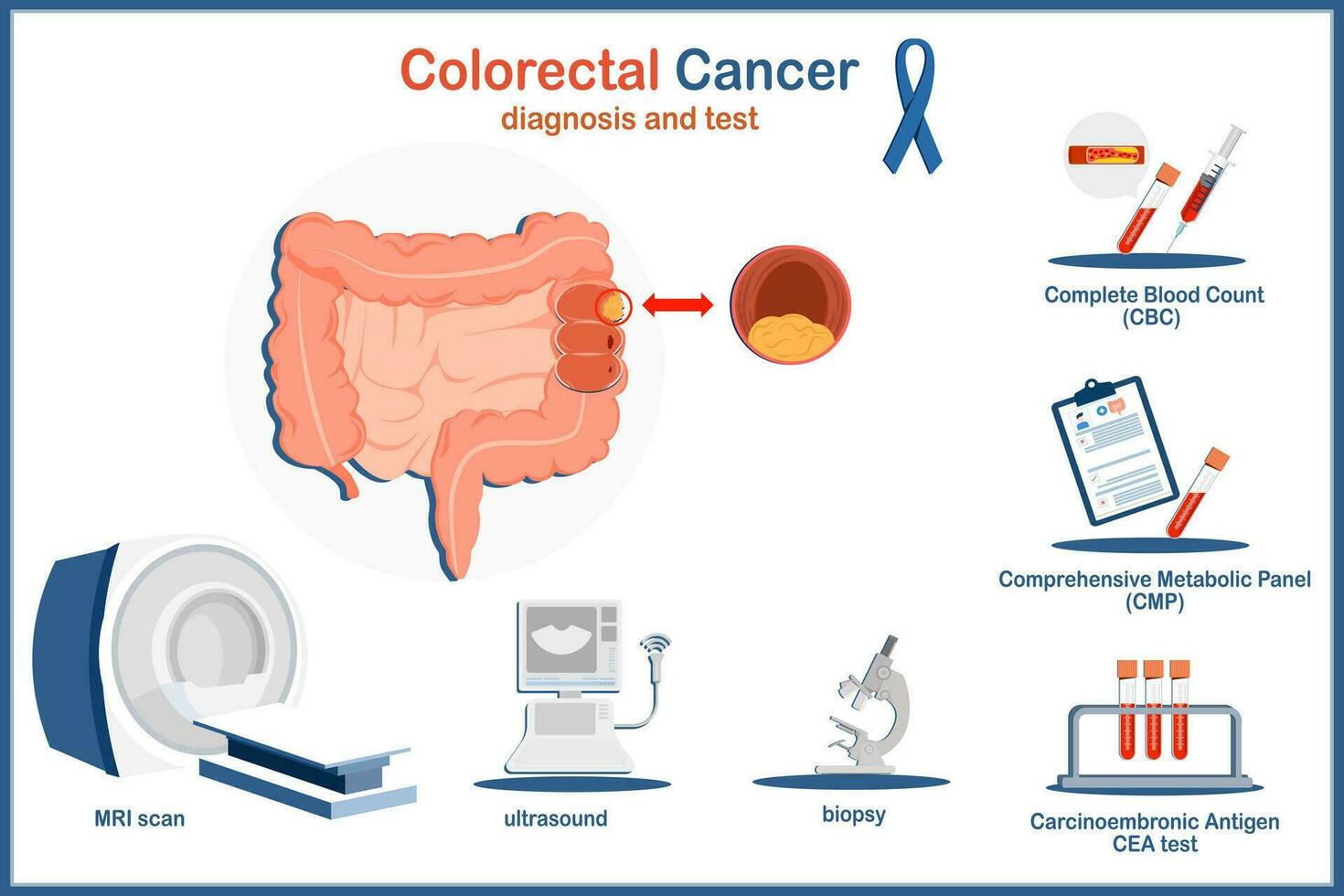 Medical Vector Illustration Concept Human Colon And Colon Cancer
