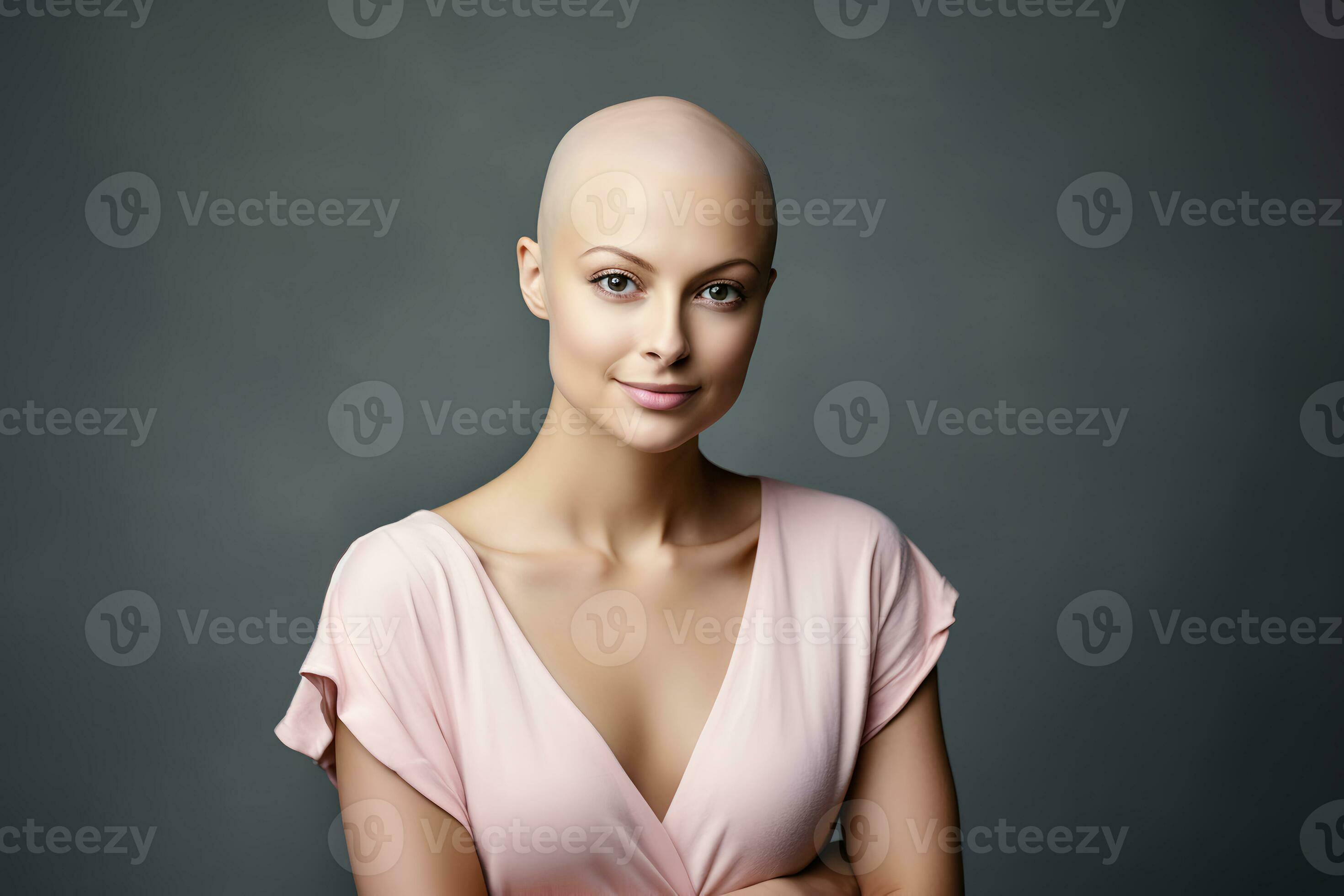 Ai Generated Portrait Of Caucasian Bald Girl Alopecia And Cancer