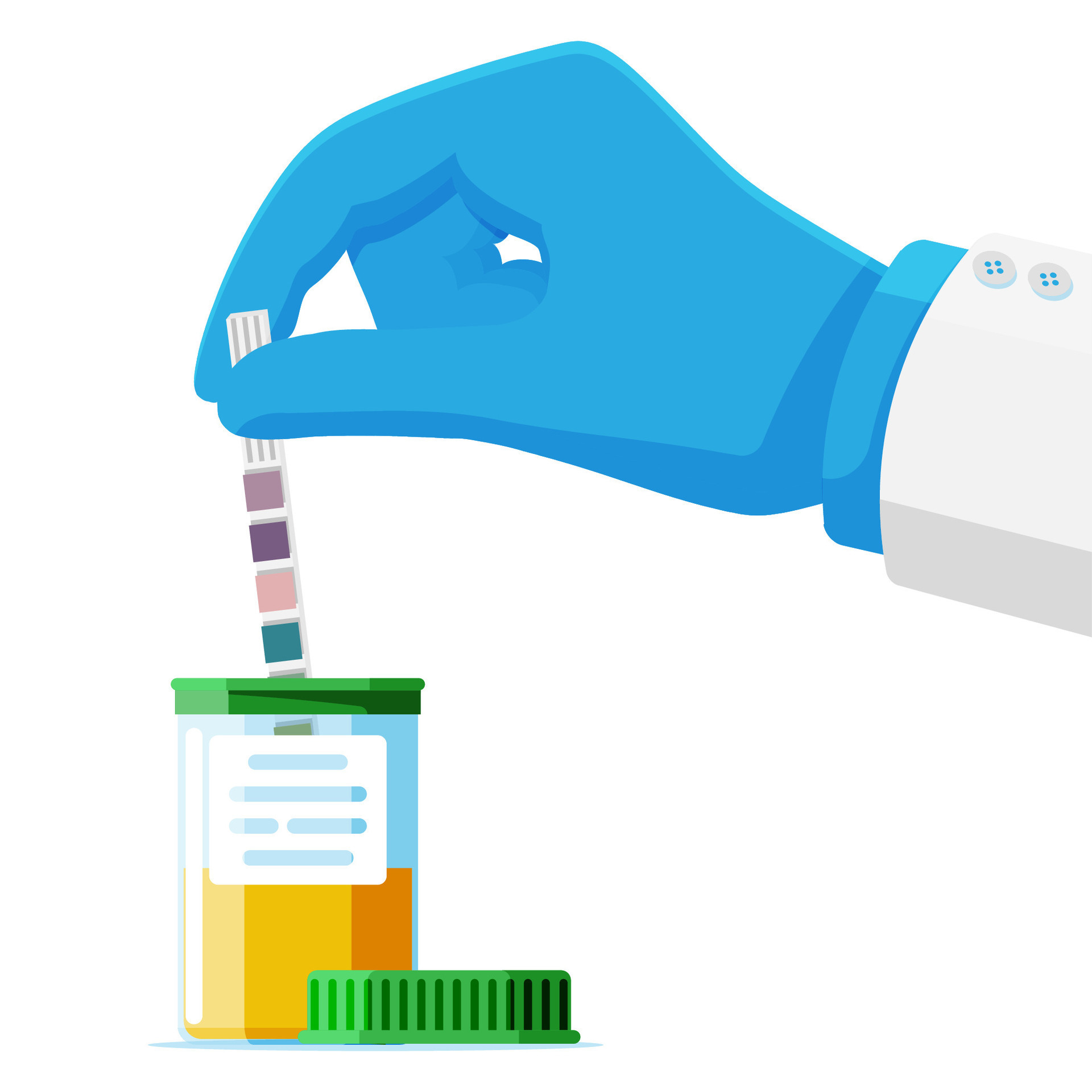 Hand Of Doctor Holding Urine Ph Test Strip In Jar Isolated Laboratory Urine Test Sample