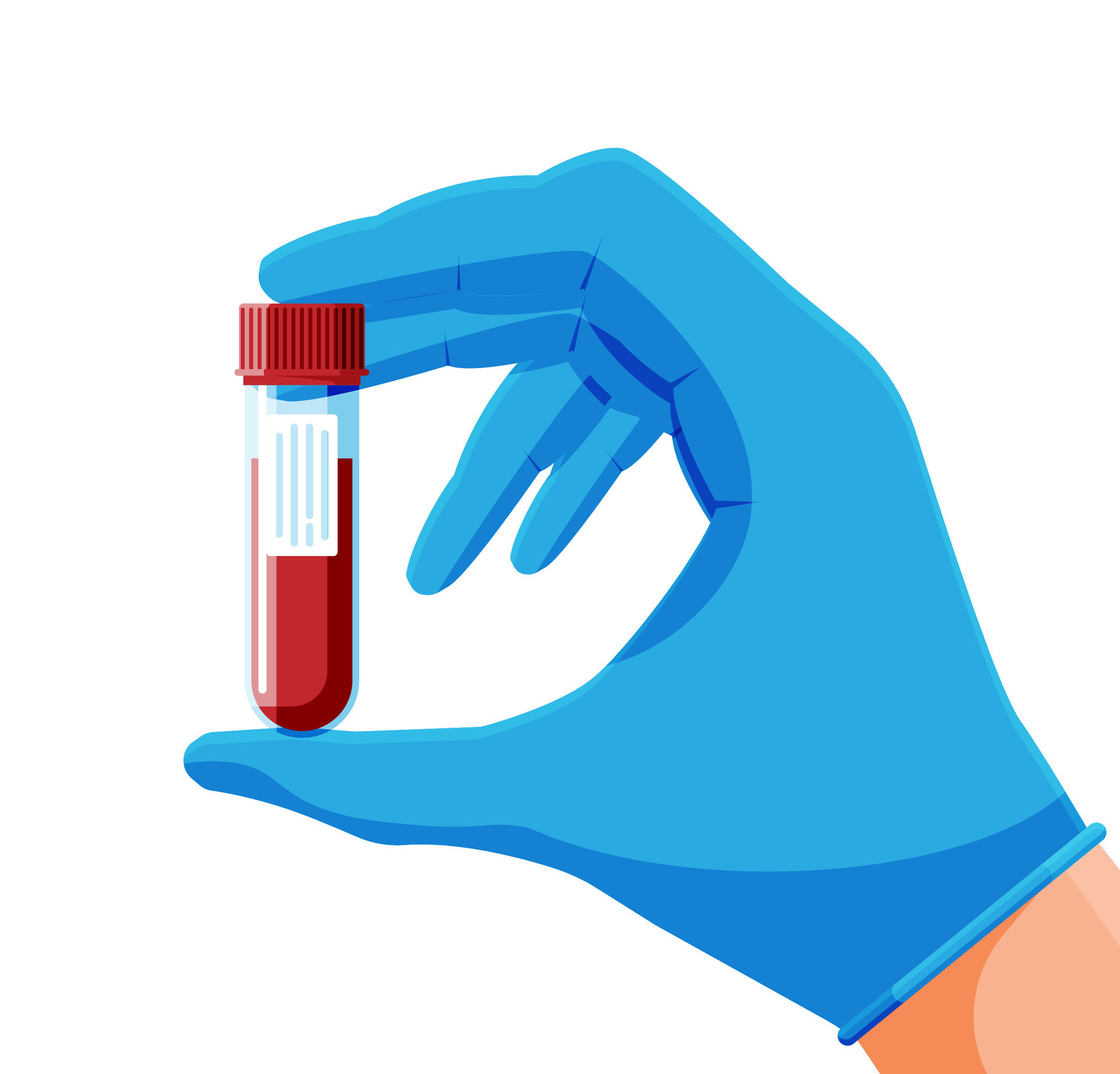 prueba tubo con sangre muestra en mano de médico aislado. general ... prueba tubo con sangre muestra en mano de médico aislado. general ...