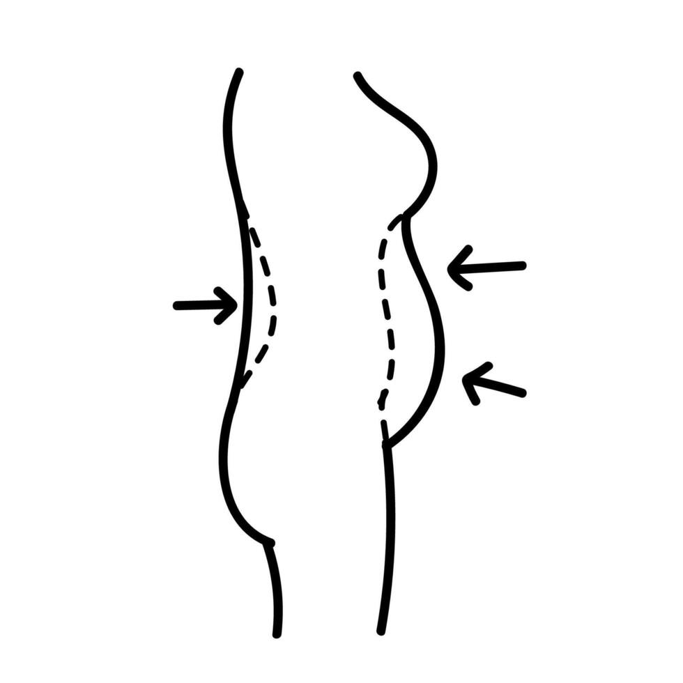 Women Beauty Face Plastic Surgery Abdominal Fat Liposuction Body