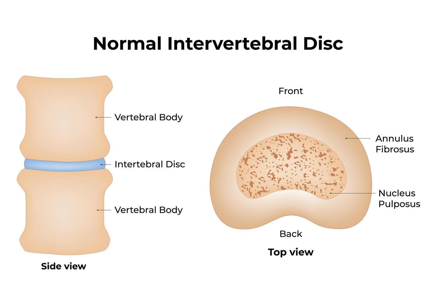 Normal Intervertebral Disc Science Design Vector Illustration Diagram ... Normal Intervertebral Disc Science Design Vector Illustration Diagram ...