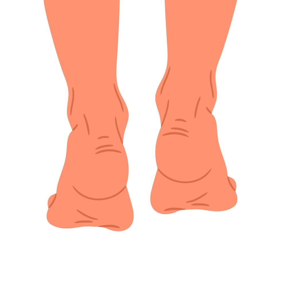 Barefoot Legs Back View Woman Walks Or Sneaks On Tiptoes Female Naked Feet Bare Pair Of Legs