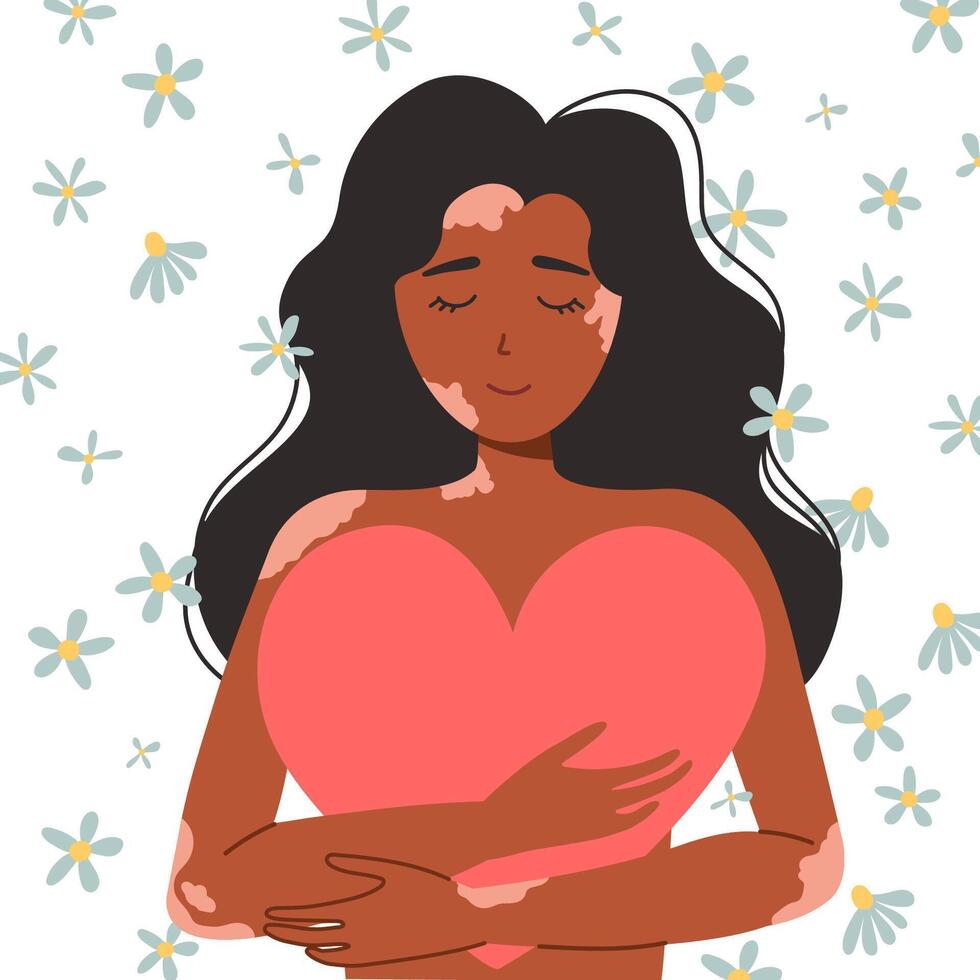 Black Woman with Vitiligo, body positivity, self love. A woman hugs a big heart. illustration ...