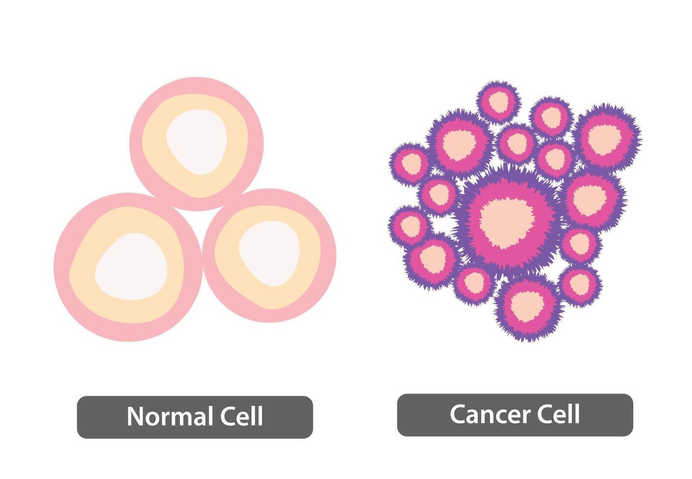 Normal Cell Vs Cancer Cell Loss Of Normal Growth Control Of Cell Healthy Tissue And Tumor