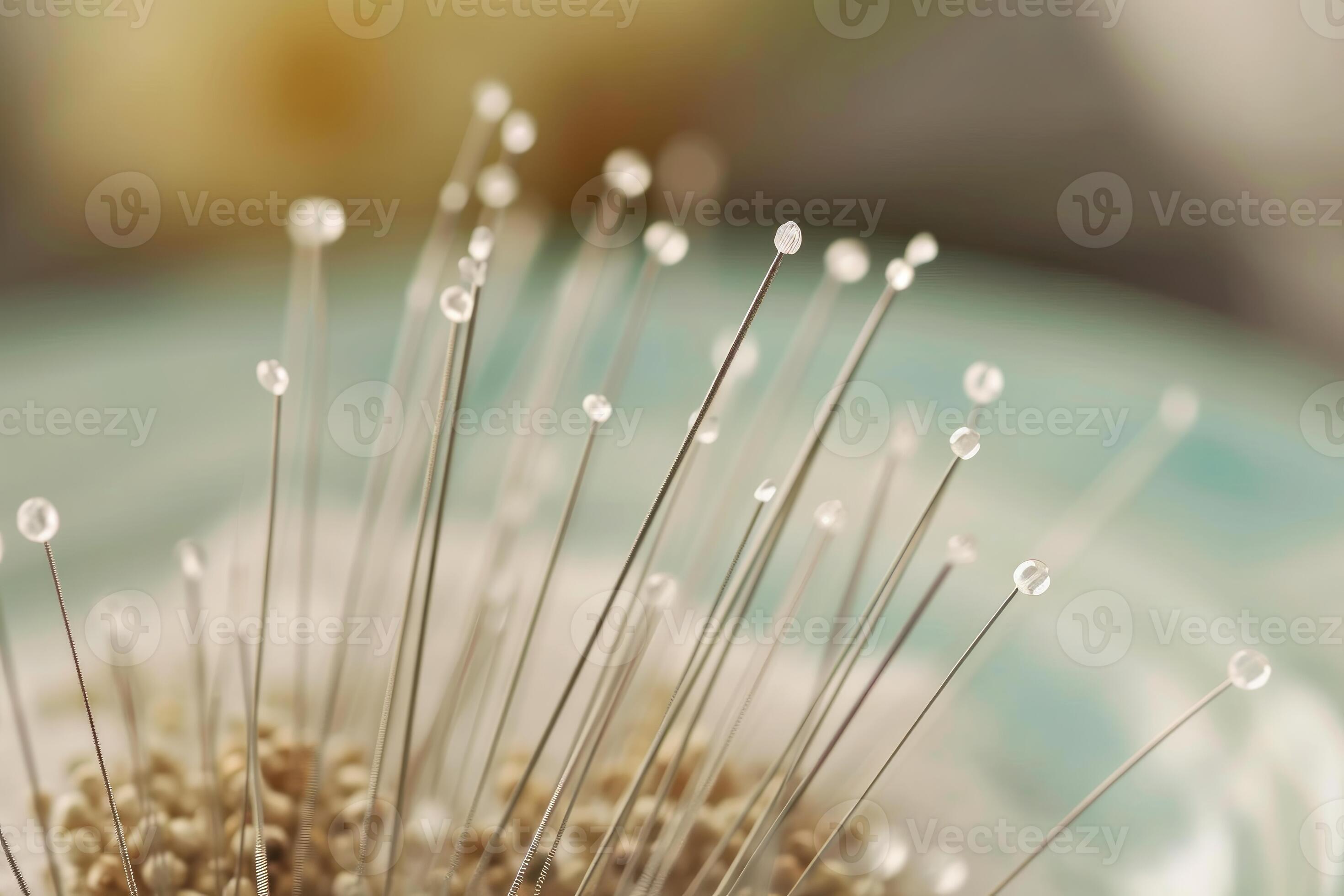 Precise Acupuncture treatment. Generate Ai 47339613 Stock Photo at Vecteezy Precise Acupuncture treatment. Generate Ai 47339613 Stock Photo at Vecteezy