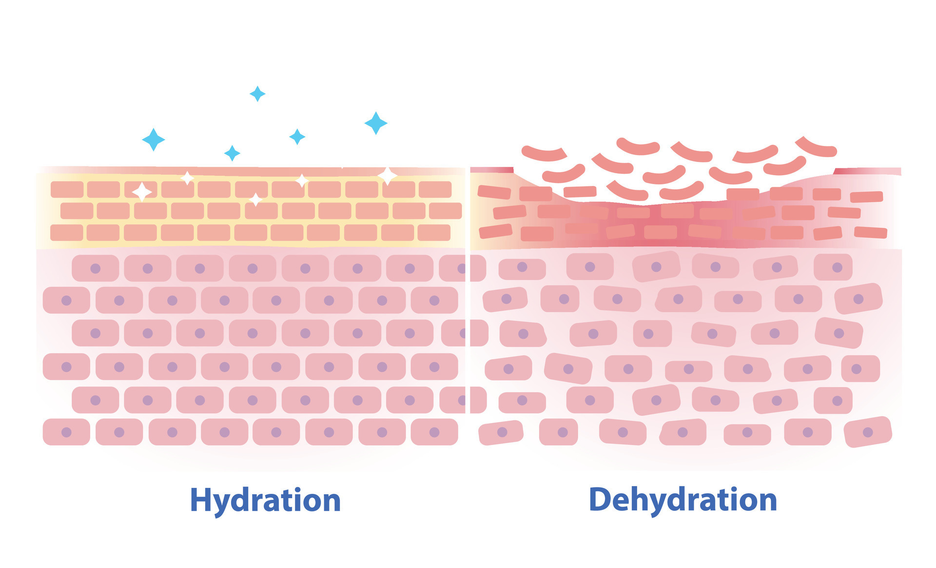 Comparison Of Hydration And Dehydration Skin Illustration Cross